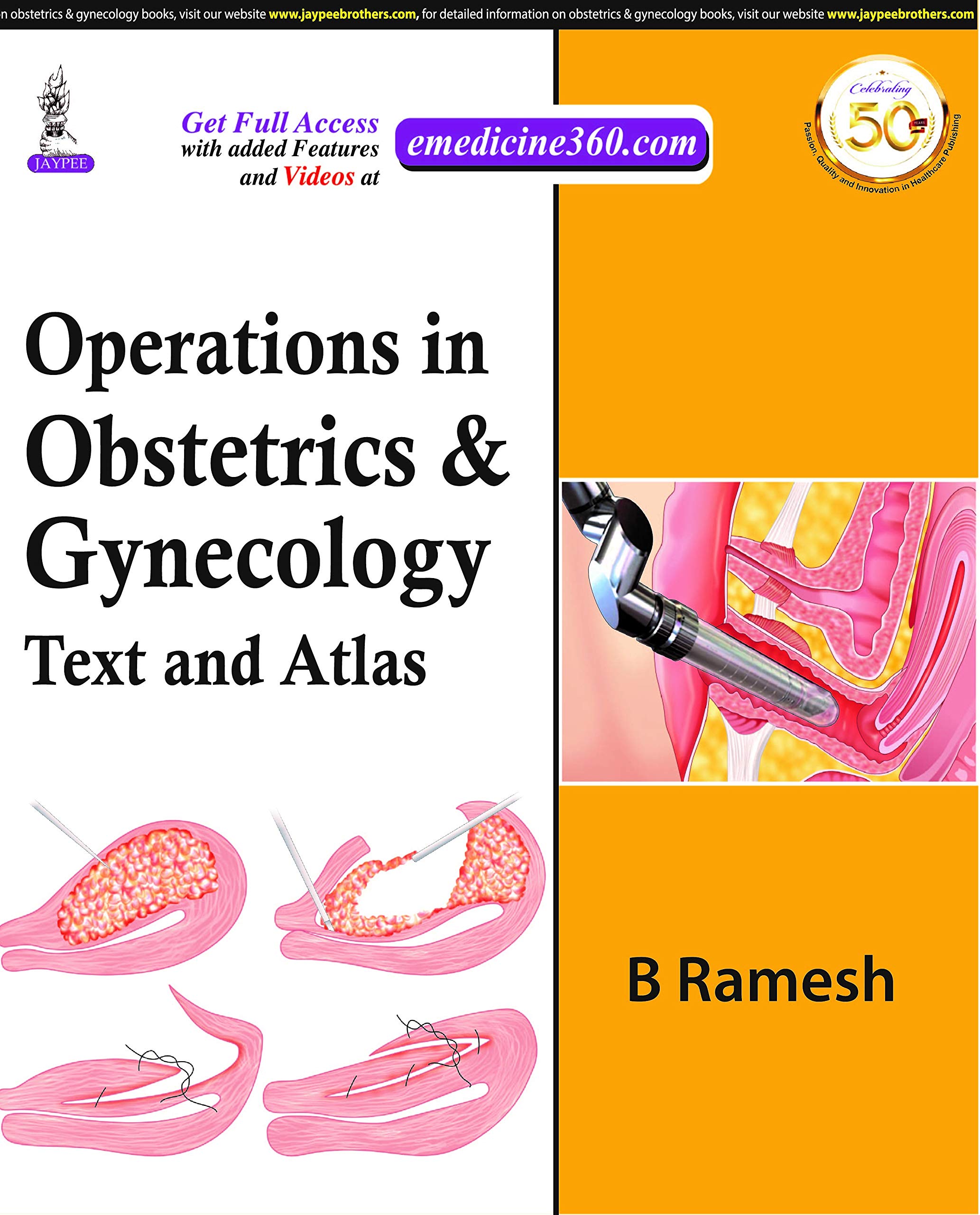 OPERATIONS IN OBSTETRICS & GYNECOLOGY TEXT AND ATLAs: 9789389776720 ...