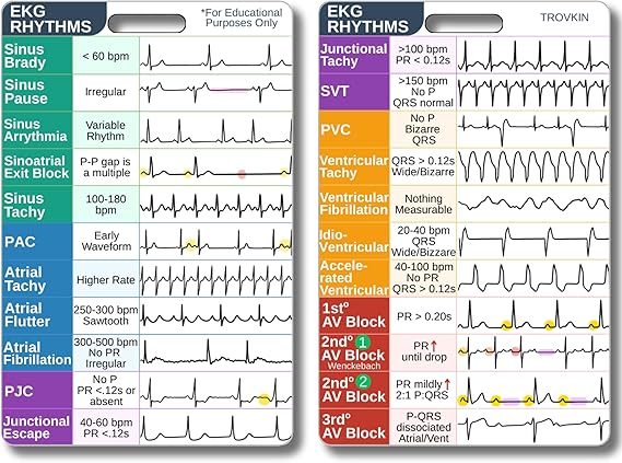 Amazon.com : EKG Rhythm Interpretation Badge Card, Nursing Telemetry ...