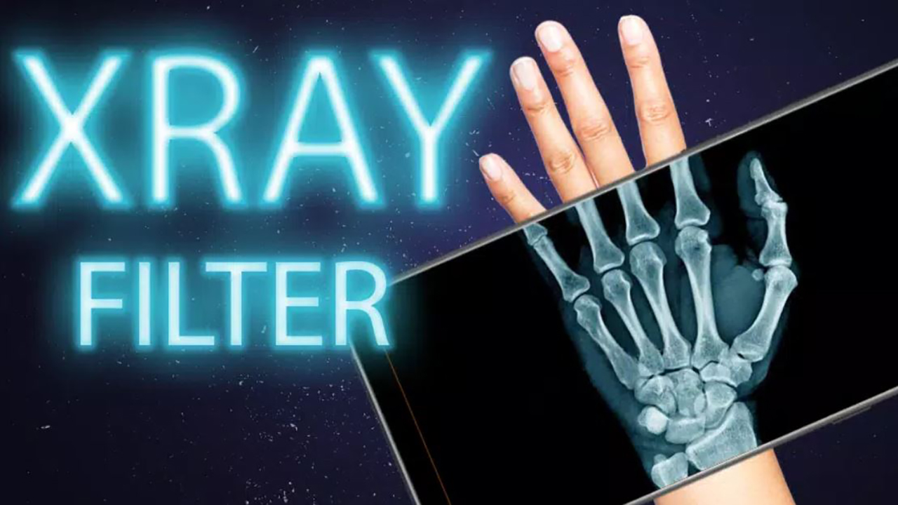 Xray Filter Photo Pro - App on Amazon Appstore