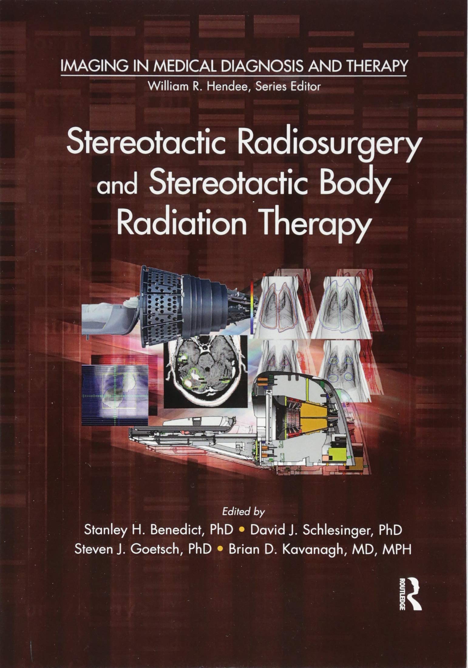 Buy Stereotactic Radiosurgery and Stereotactic Body Radiation Therapy ...