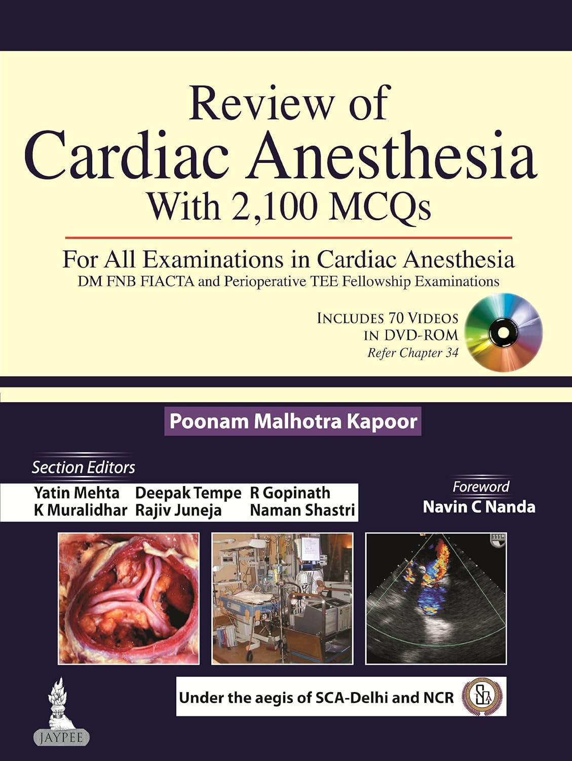 Review of Cardiac Anesthesia With 2,100 MCQs: 9789350906590: Medicine ...