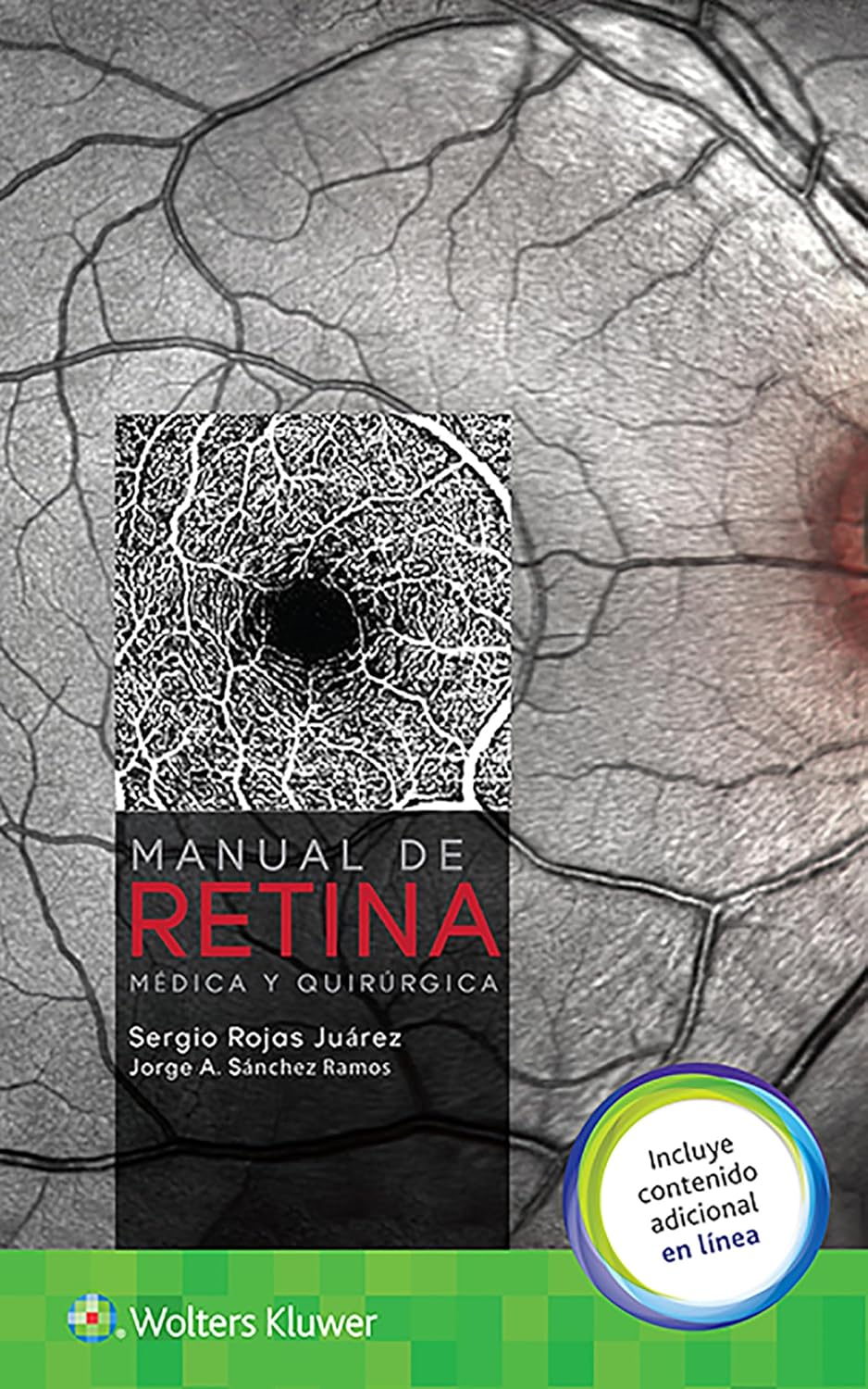 Manual de retina médica y quirúrgica (Spanish Edition): 9788416781911 ...