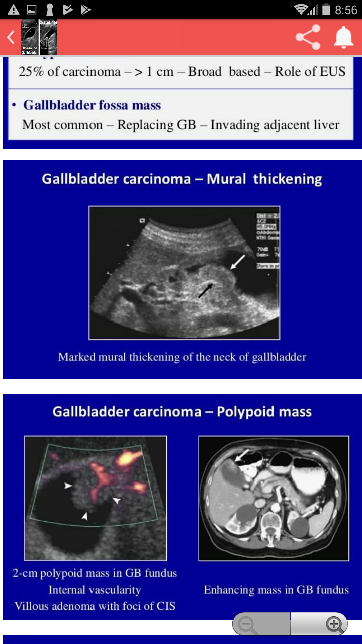 UltraSound Gallbladder - App on Amazon Appstore