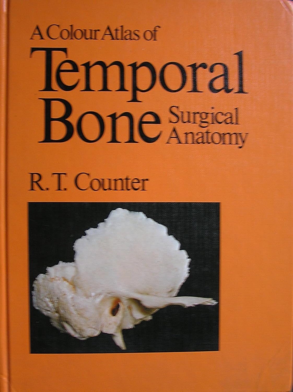 Amazon | A Colour Atlas of Temporal Bone Surgical Anatomy | Counter, R ...