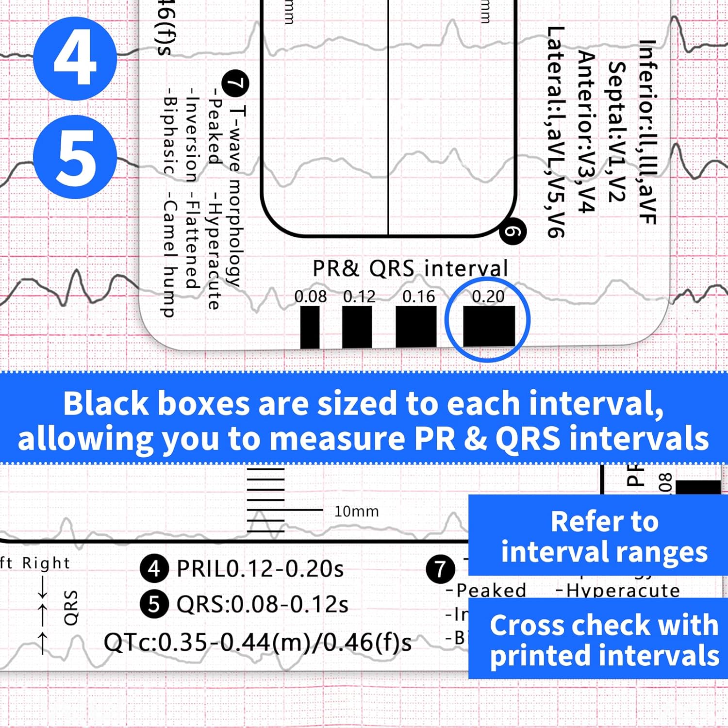 2pcs EKG 7 Step Ruler, EKG Ruler Plastic Ruler Nepal | Ubuy