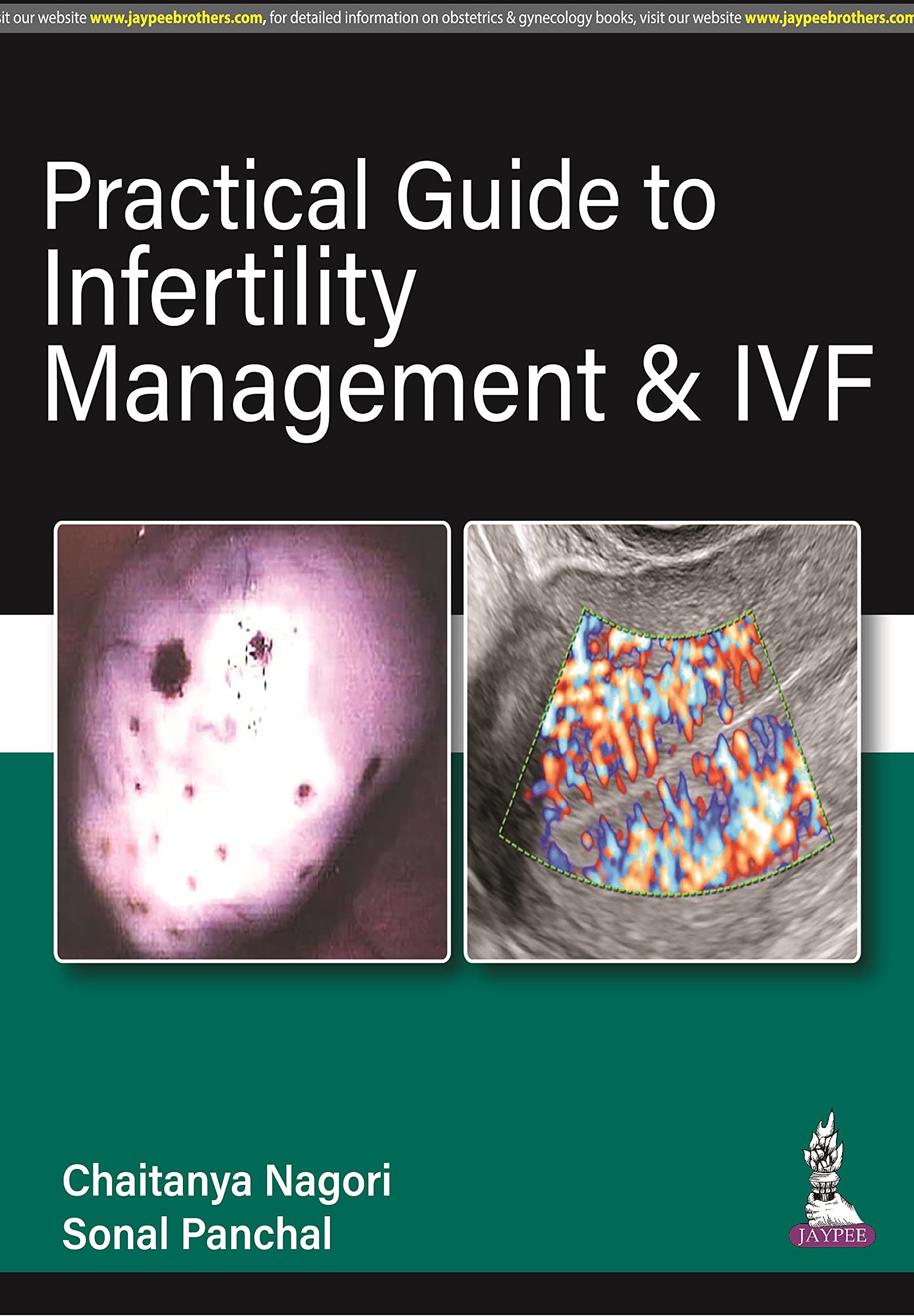 Practical Guide to Infertility Management and IVF: 9789390595914 ...