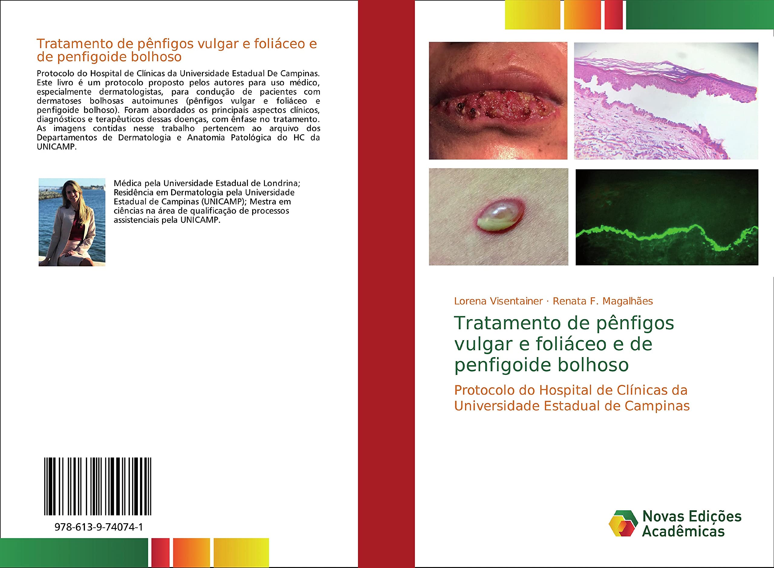 Penfigoide Bolhoso