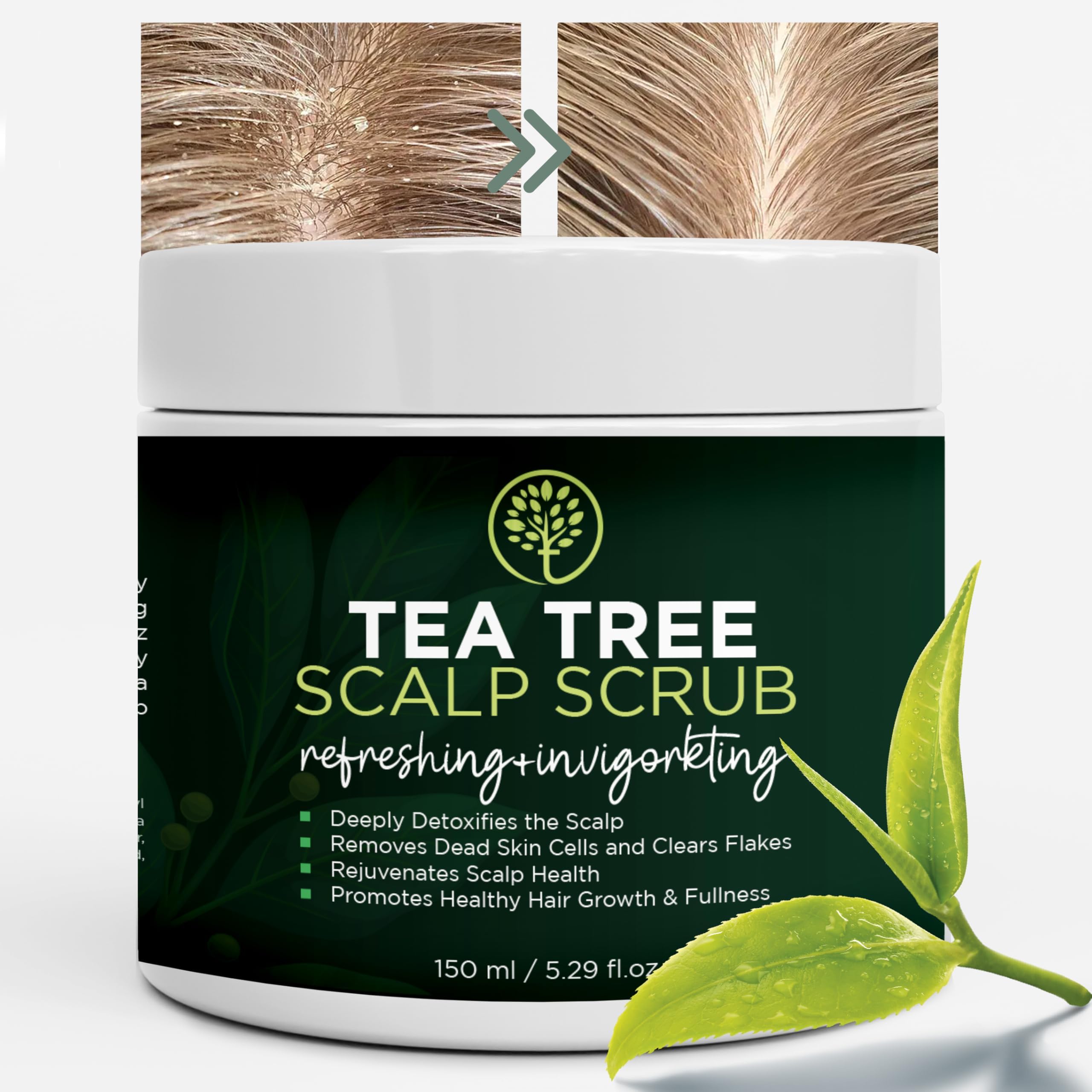 Amazon.com: Tea Tree Scalp Scrub | Antifungal Itchy Scalp Treatment ...