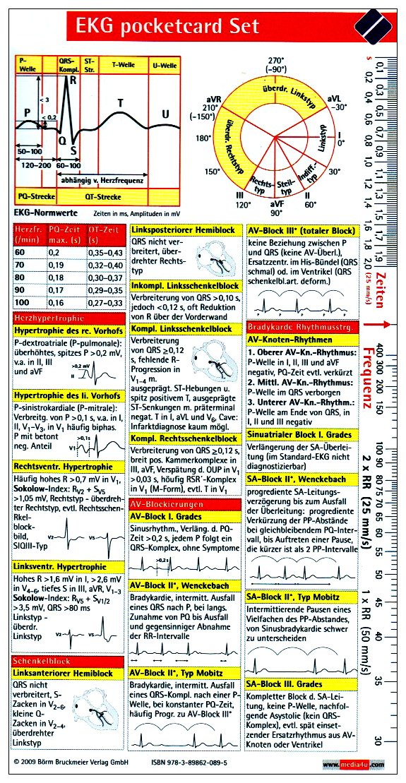 EKG pocketcard Set : Amazon.co.uk: Books