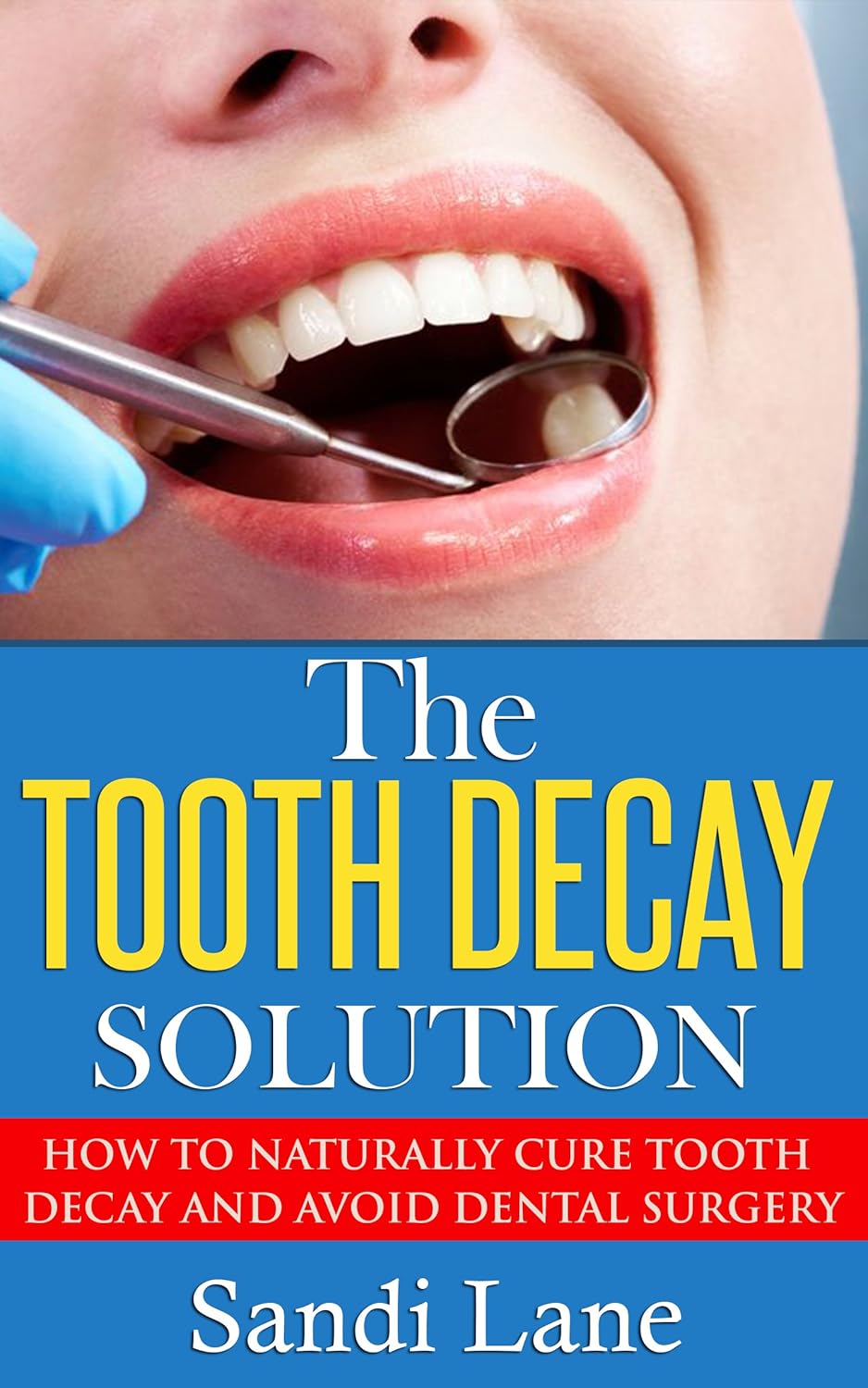 Amazon.com: The Tooth Decay Solution: How to Naturally Cure Tooth Decay ...