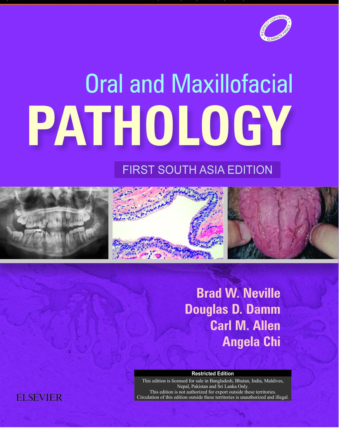 Oral and Maxillofacial Pathology: 1st South Asia Edition: Brad W ...