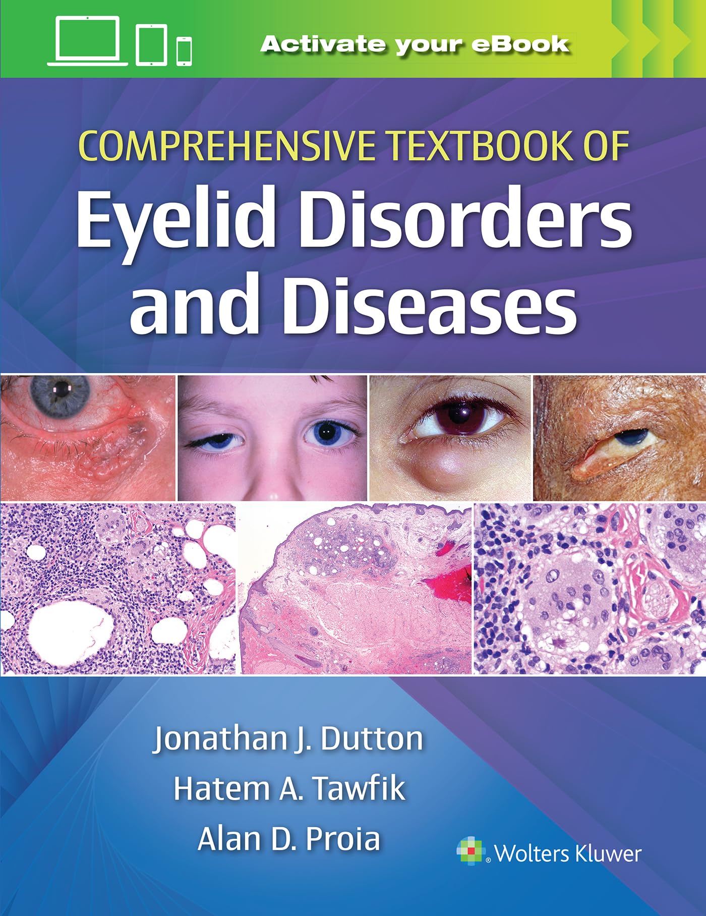 Comprehensive Textbook of Eyelid Disorders and Diseases: 9781975146146 ...