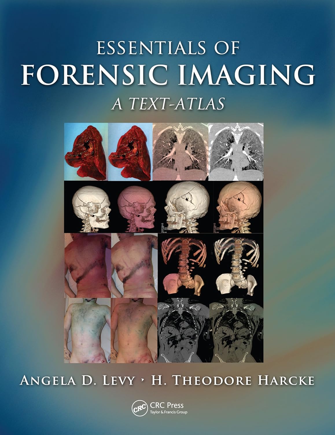 Amazon.com: Essentials of Forensic Imaging: A Text-Atlas eBook : Levy ...