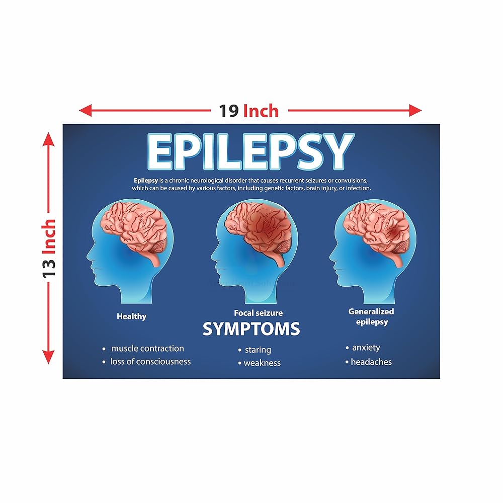 Anne Print Solutions® Epilepsy chart Poster Size 13 Philippines | Ubuy