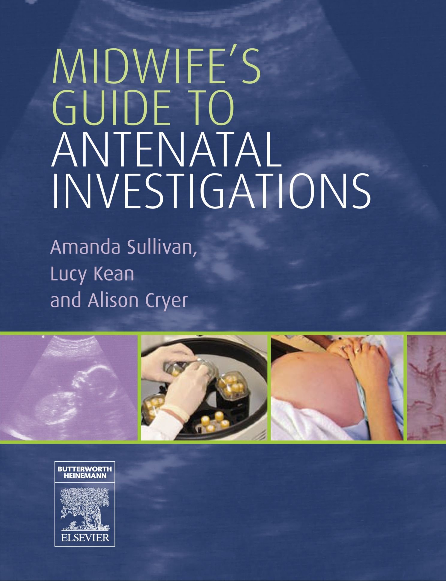 Midwife's Guide to Antenatal Investigations: 8601300273914: Medicine ...