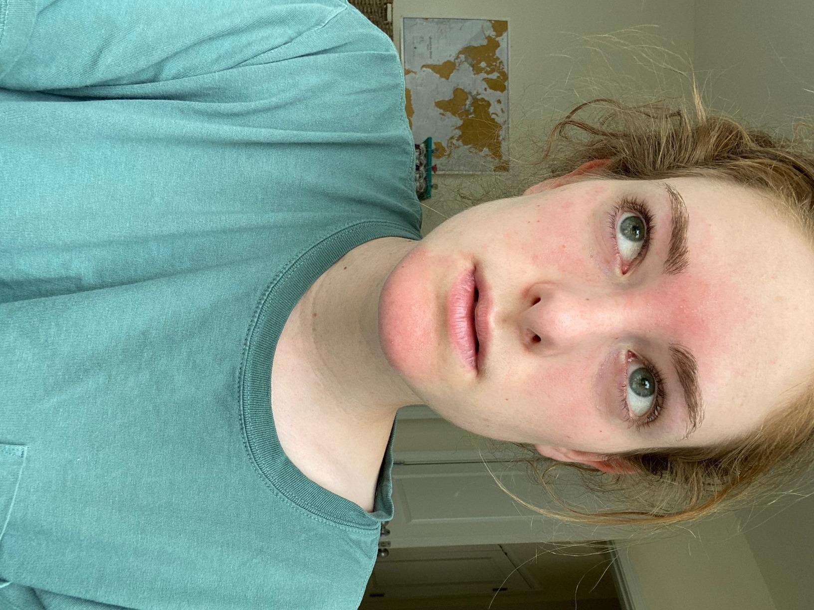 Amazon.com: NEW Glossier Zit Stick (Acne Spot Treatment) : Beauty ...