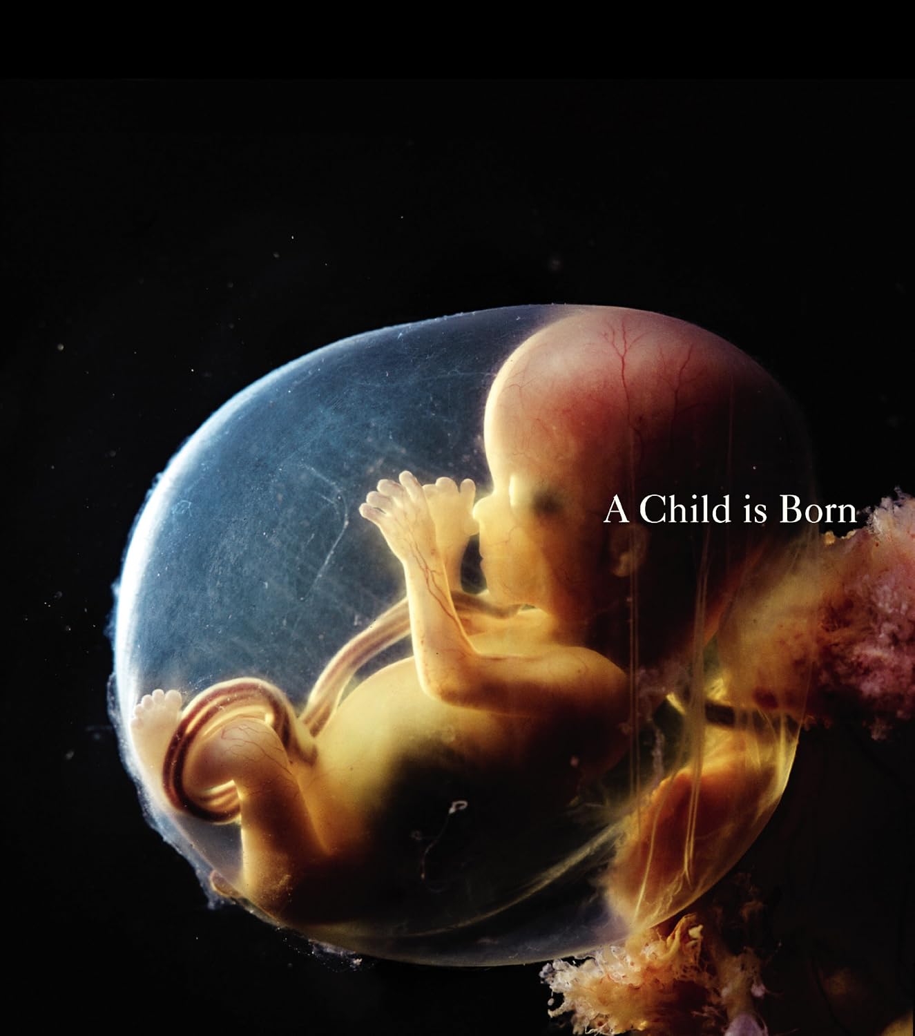 A Child is Born: Amazon.co.uk: Nilsson, Lennart: 9780224089944: Books