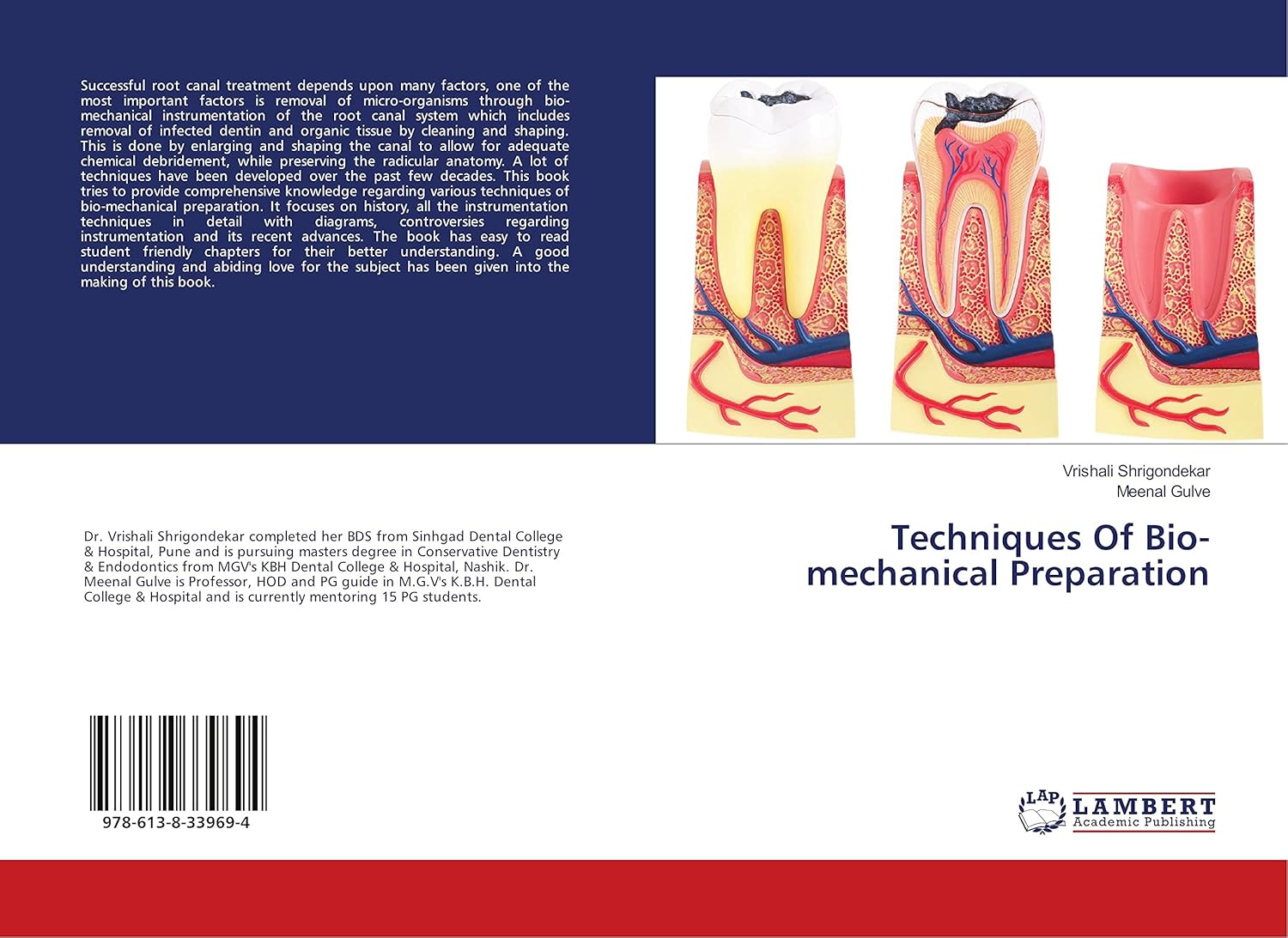 Techniques Of Bio-mechanical Preparation: Shrigondekar, Vrishali, Gulve ...
