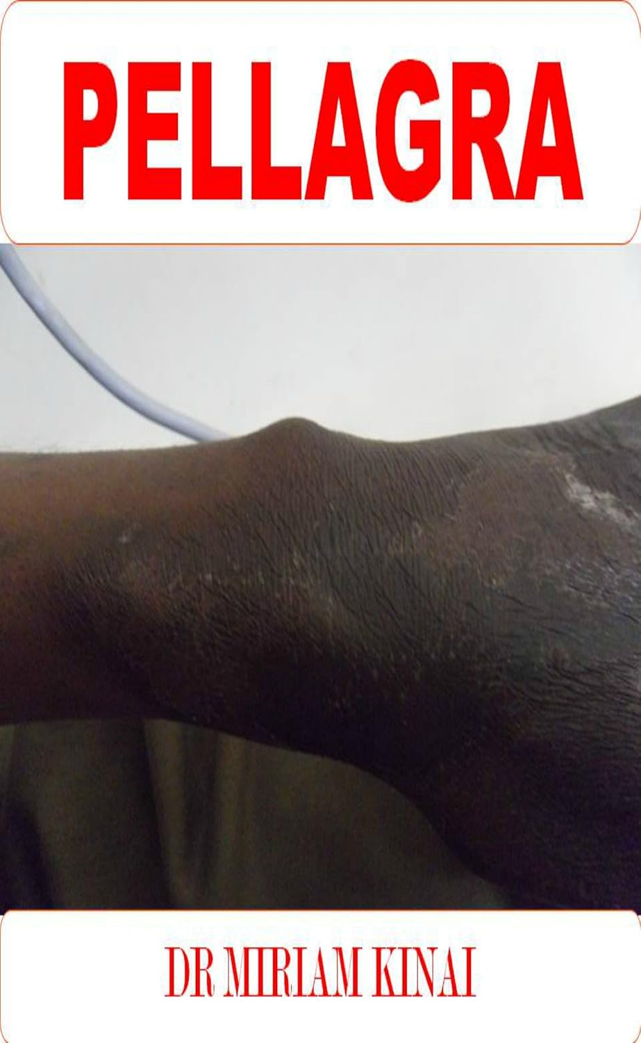 Dermatology: Pellagra (Skin Diseases Book 21) - Kindle edition by Kinai ...