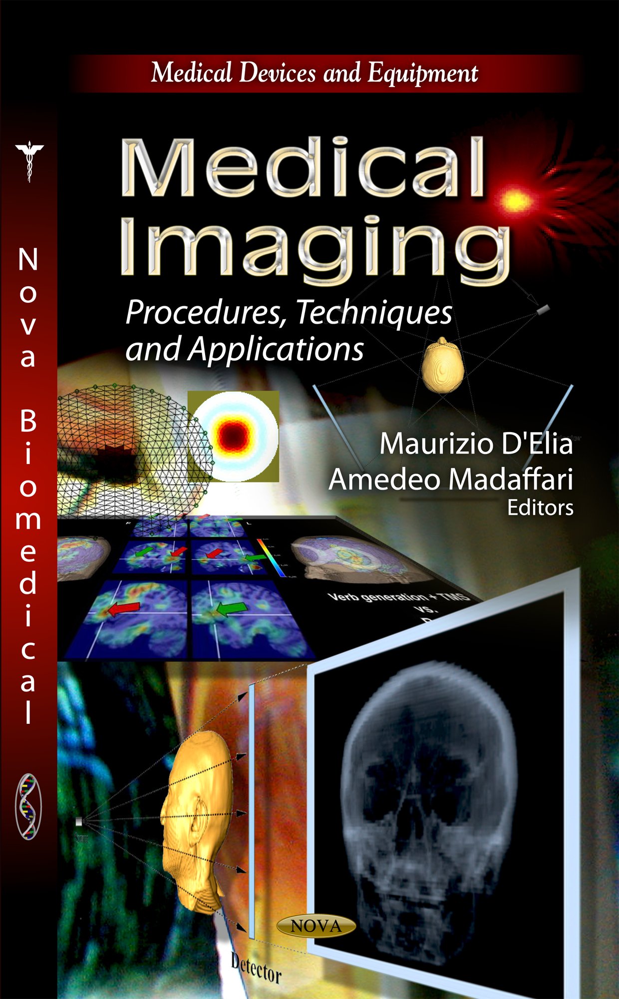 Buy Medical Imaging: Procedures, Techniques & Applications (Medical ...