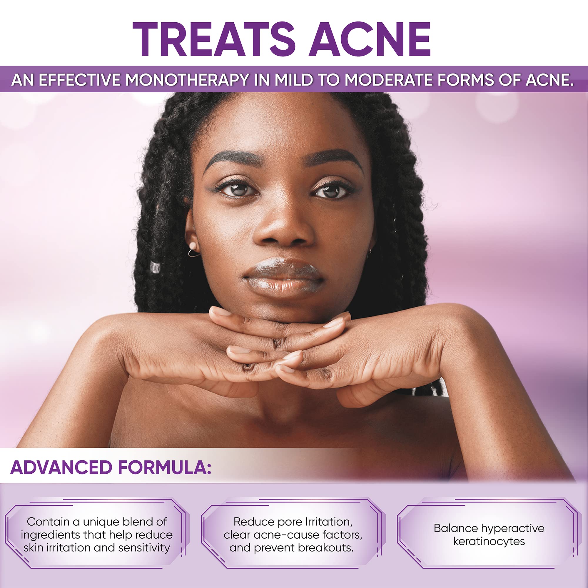 Snapklik.com : AOBBIY 10% Azelaic Acid Cream: Acne Treatment - Acne ...
