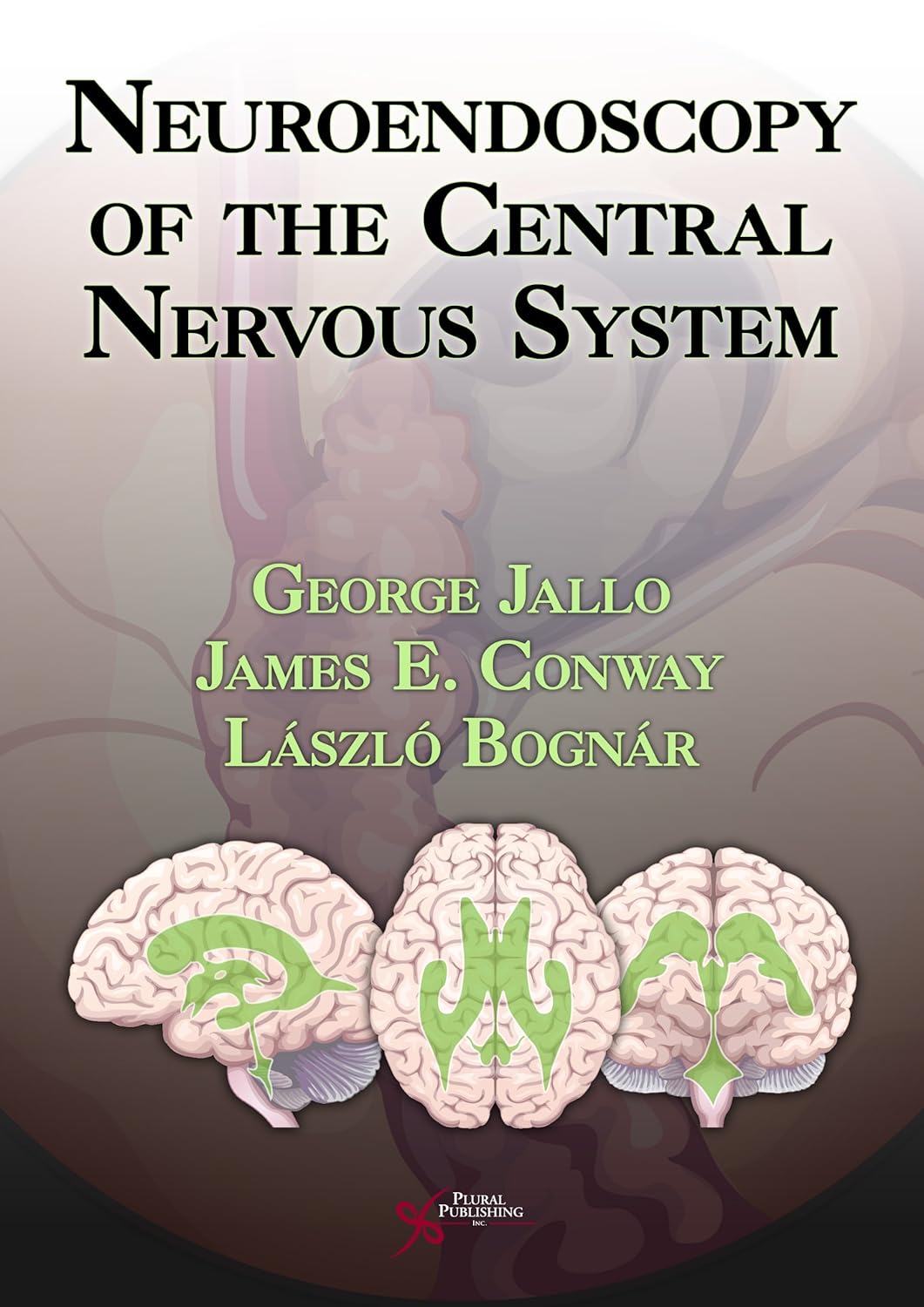Neuroendoscopy of the Central Nervous System: 9781597561419: Medicine ...