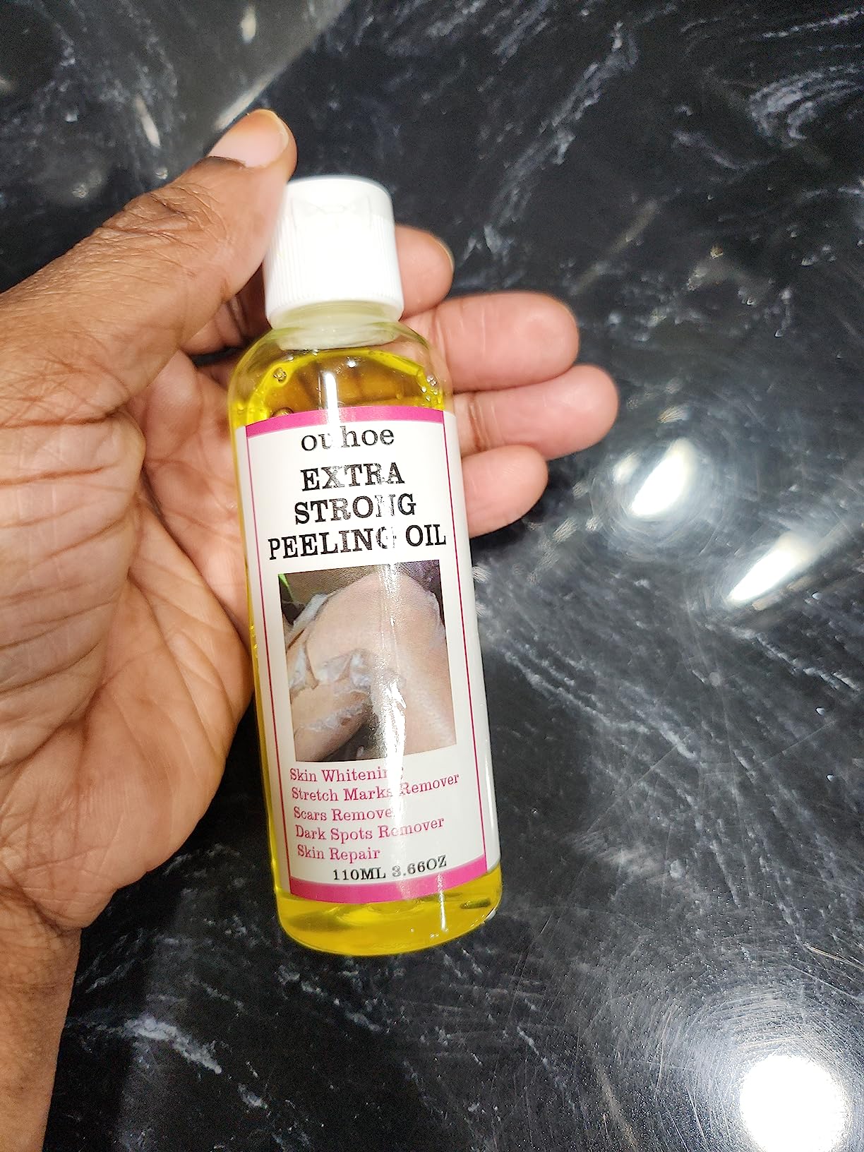 Amazon.com: QLASIC Peeling Oil for Dark Skin, Yellow Peeling Oil ...