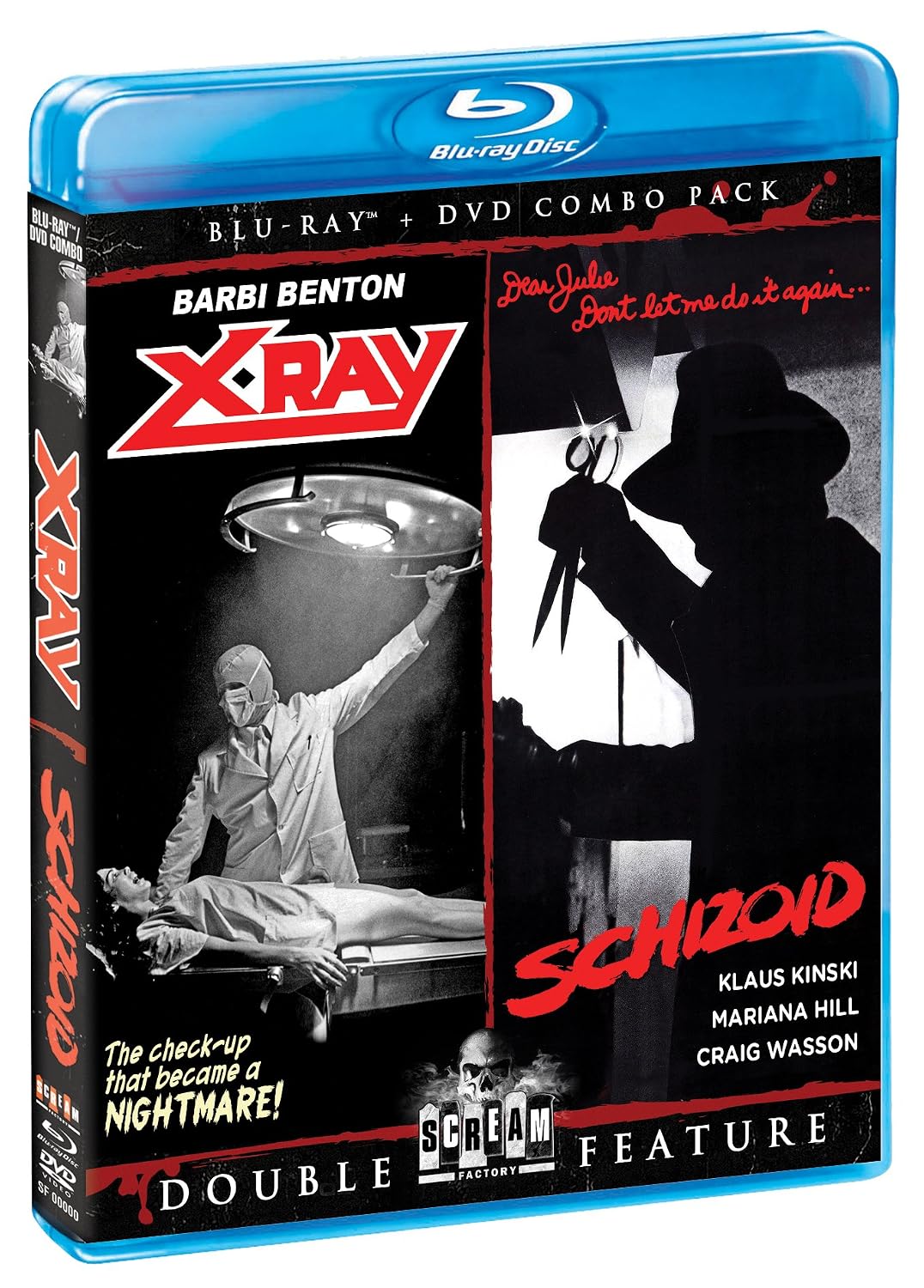 Amazon.com: X RAY/SCHIZOID (BD) : Klaus Kinski, Barbi Benton, Marianna ...
