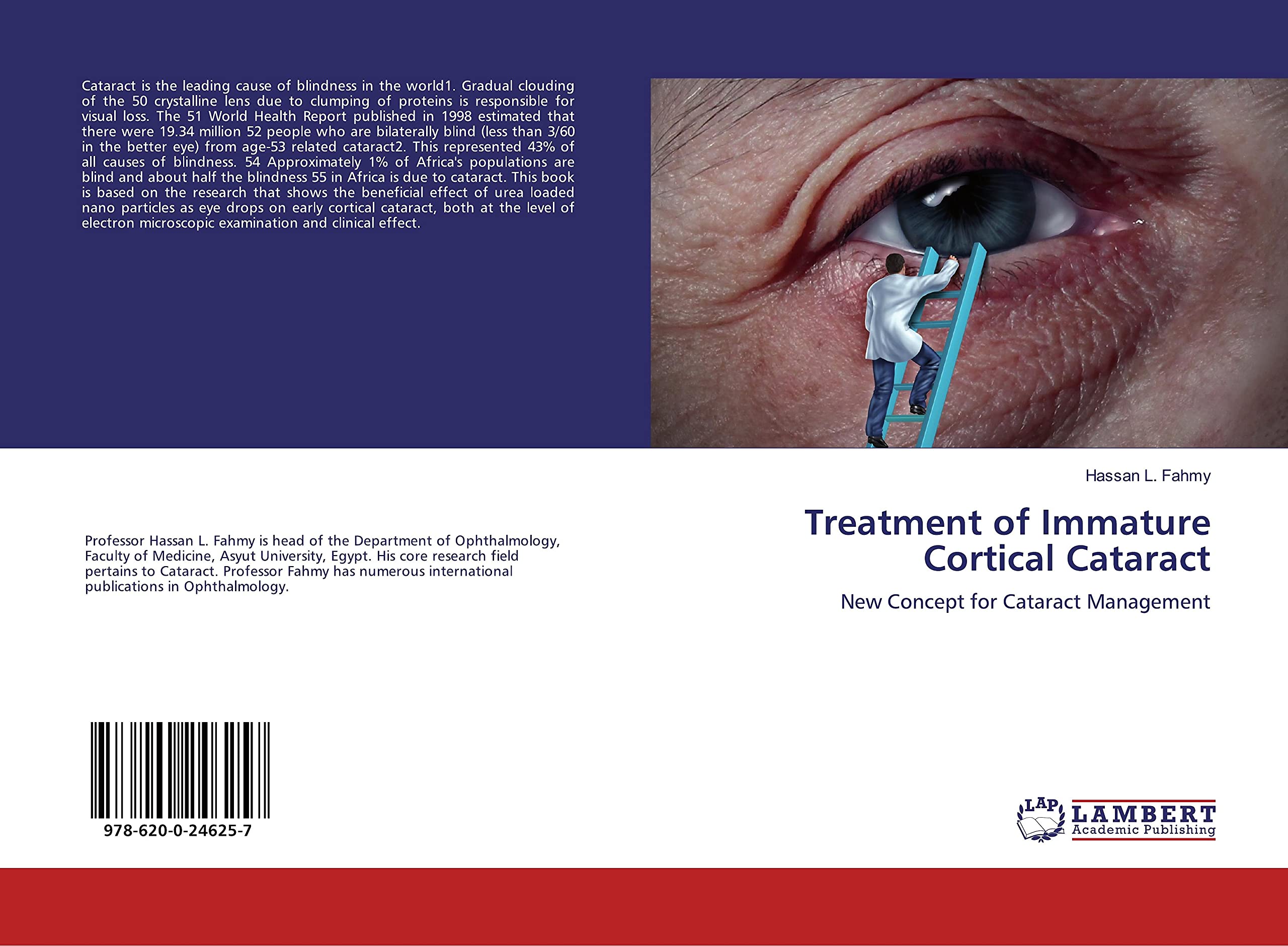 Cortical Cataract The Different Types Of Cataracts And Their Impact On