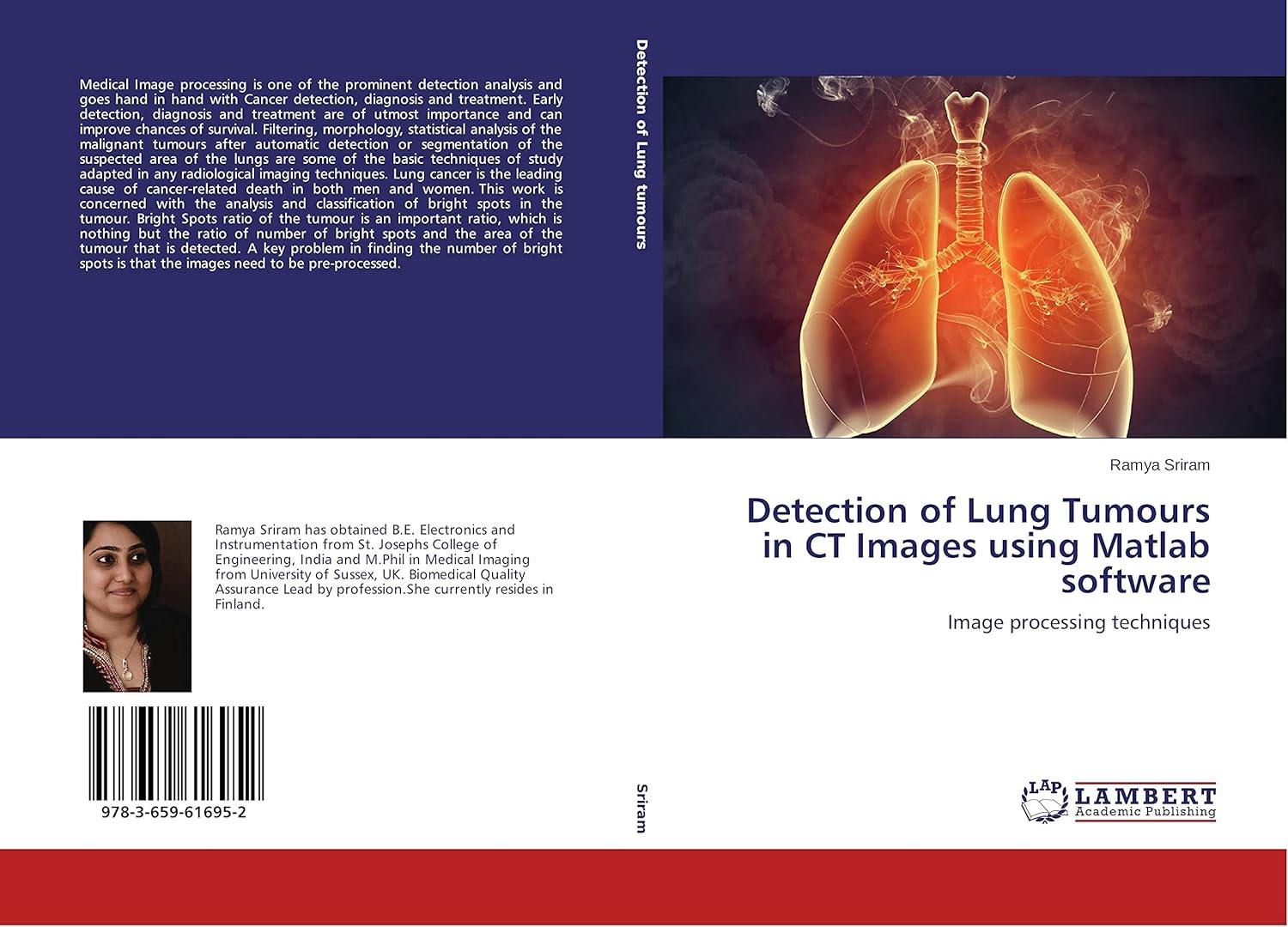 Detection of Lung Tumours in CT Images using Matlab software: Image processing techniques ...