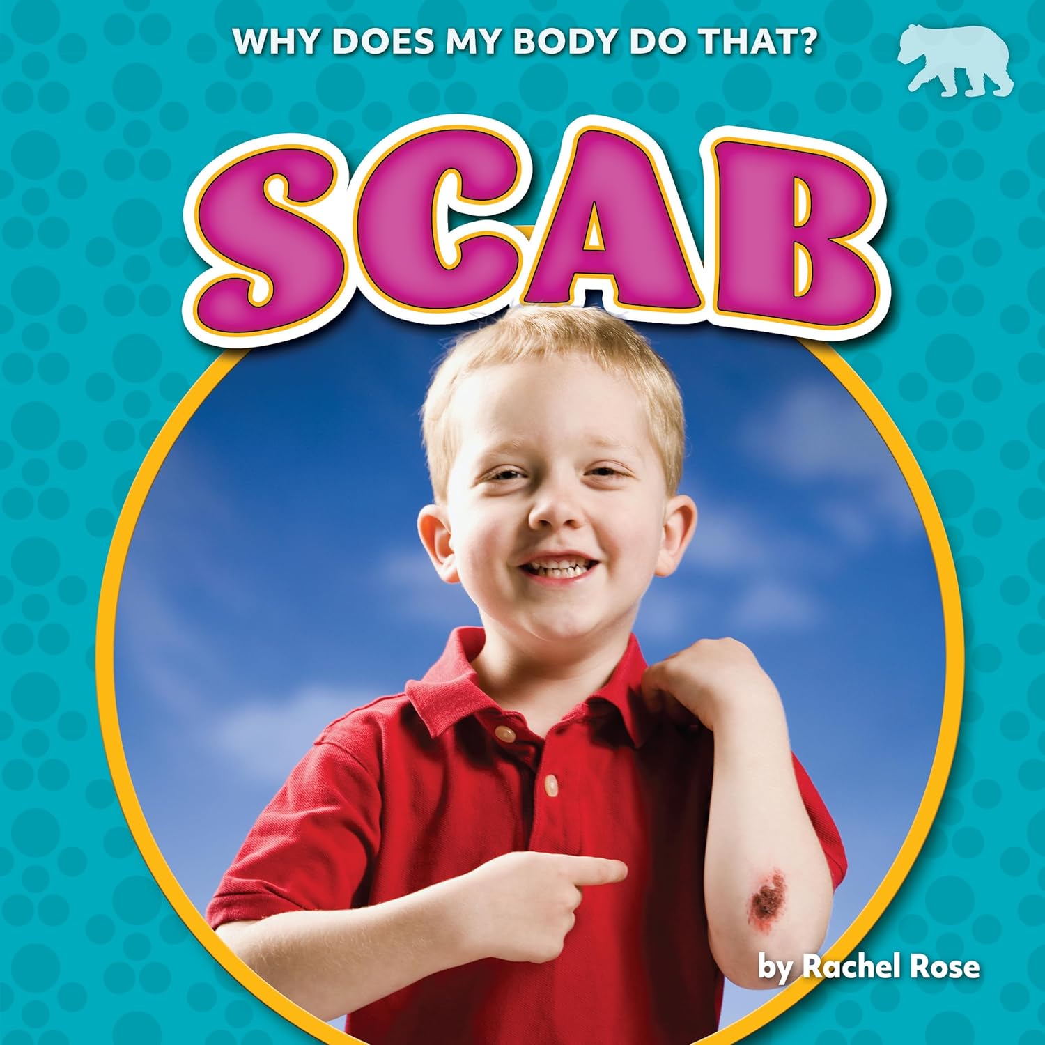 Scab - Nonfiction Reading for Grade 1 with Vibrant Illustrations ...