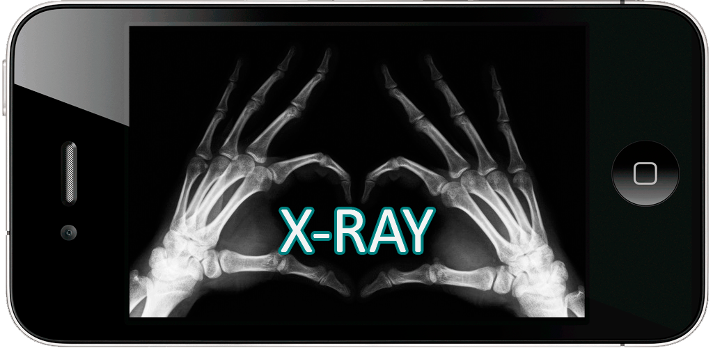 Best X-Ray Simulator - App on Amazon Appstore