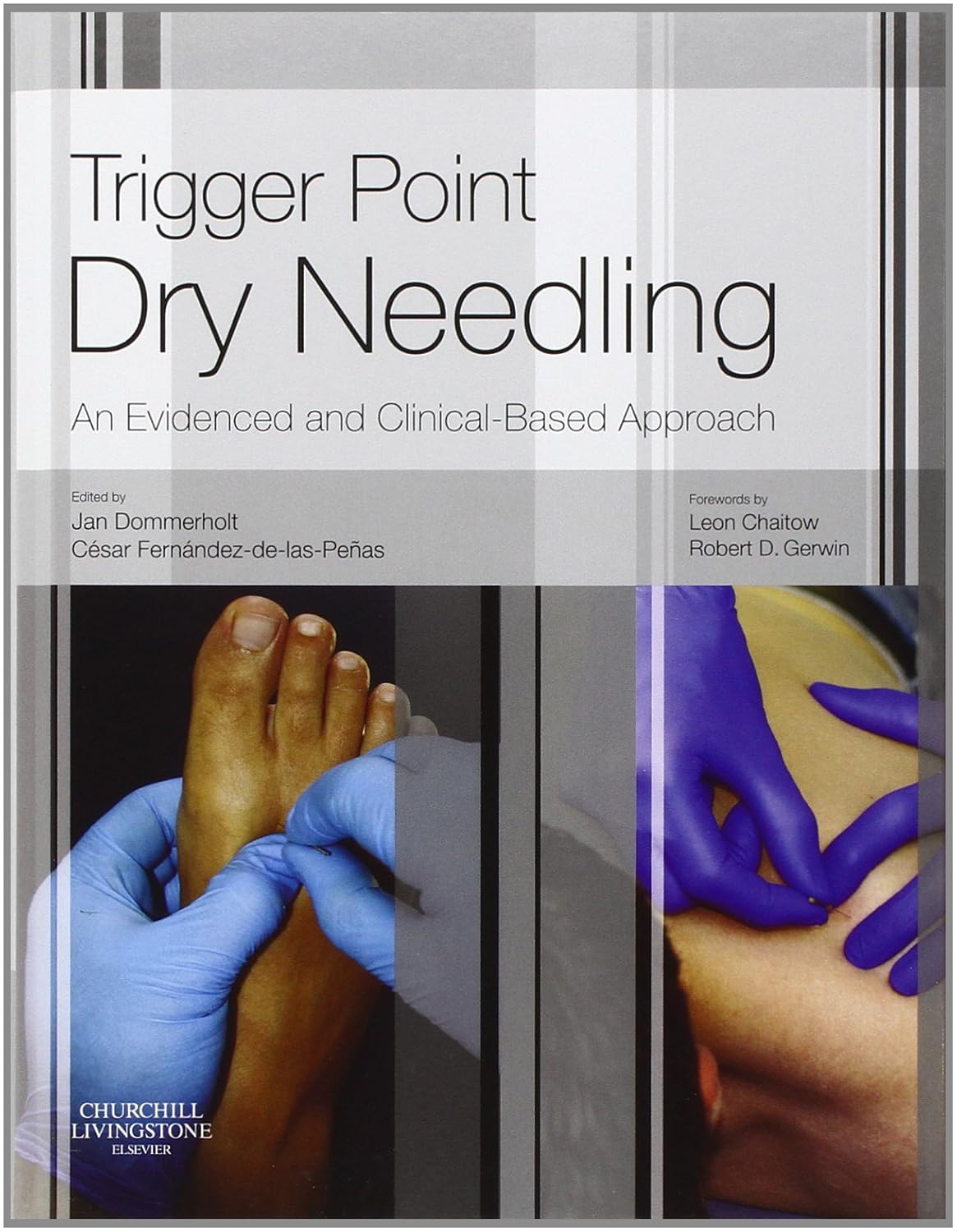 Trigger Point Dry Needling: An Evidence and Clinical-Based Approach ...