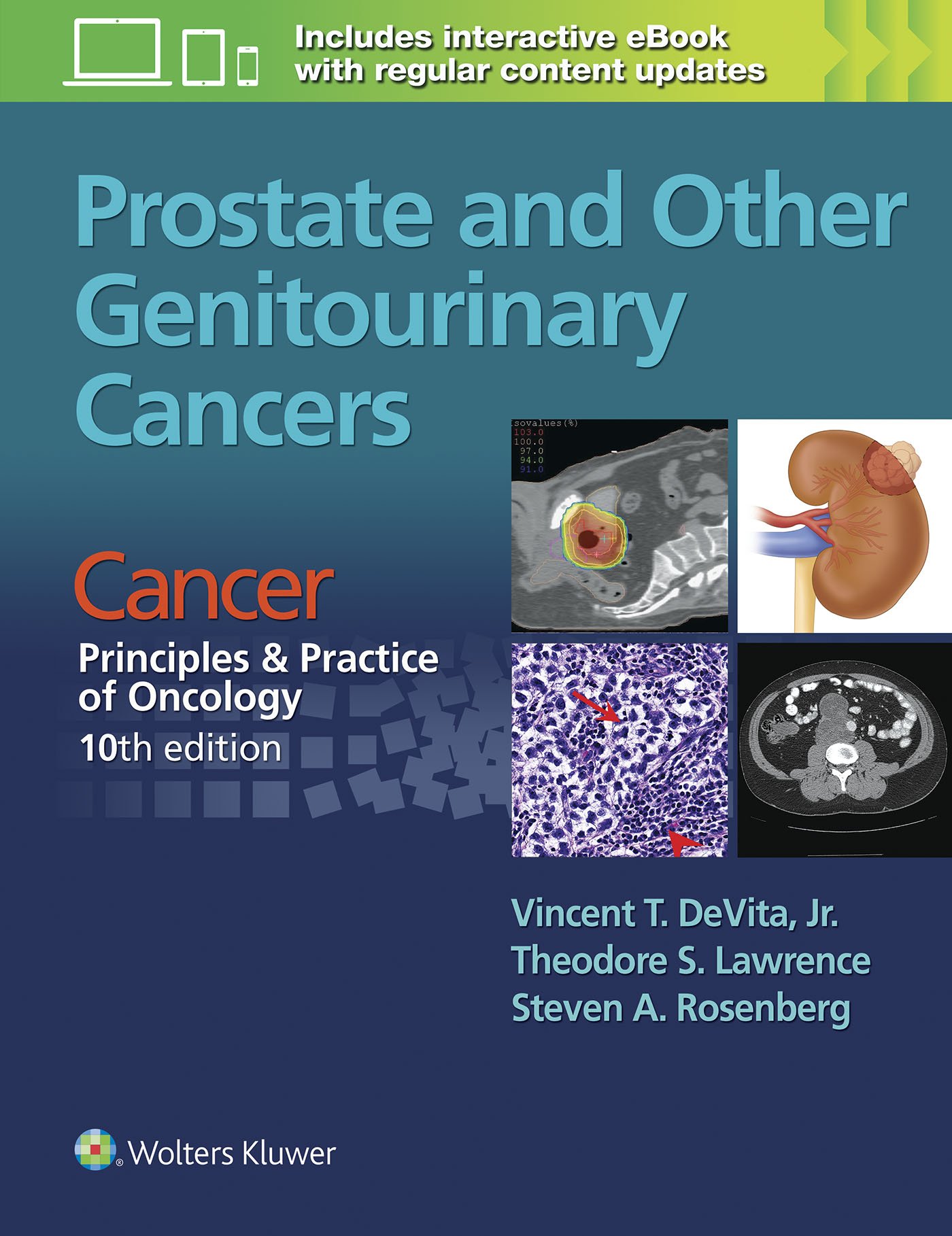 Buy PROSTATE AND OTHER GENITOURINARY CANCERS 10ED (PB 2016): From ...