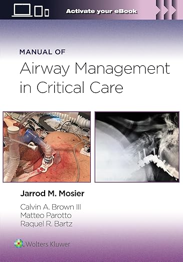 Manual of Airway Management in Critical Care: Print + eBook with ...