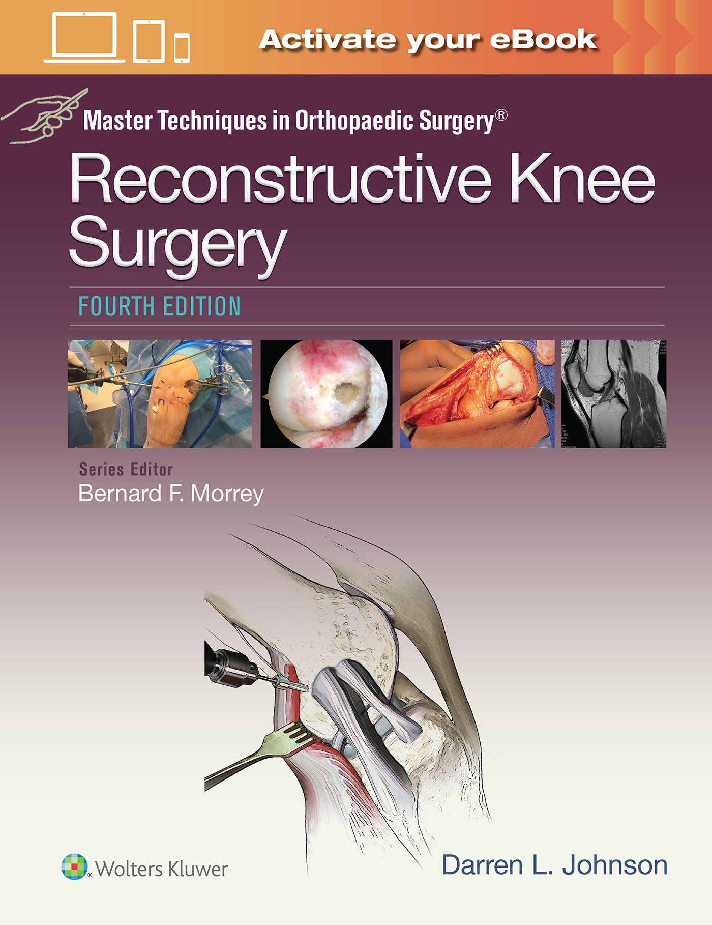 Buy MASTER TECHNIQUES IN ORTHOPACEDIC SURGERY RECONSTRUCTIVE KNEE ...