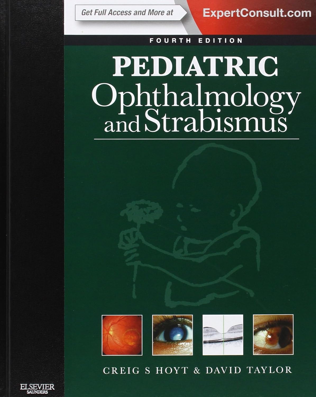 Pediatric Ophthalmology and Strabismus: Expert Consult - Online and ...