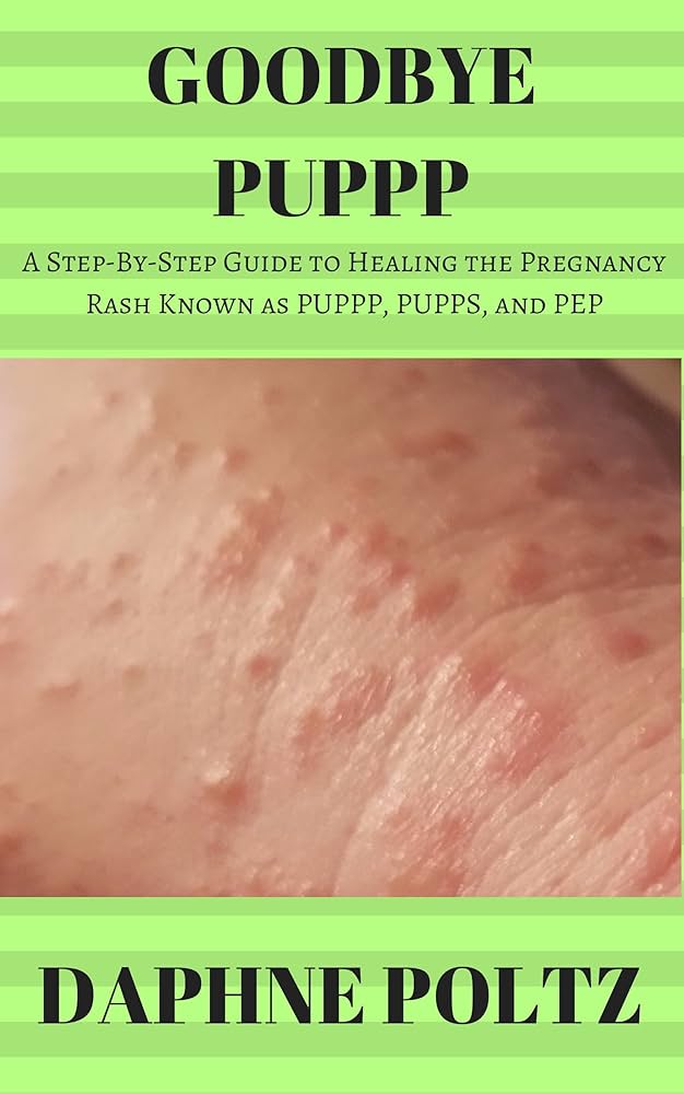 Puppp After Delivery