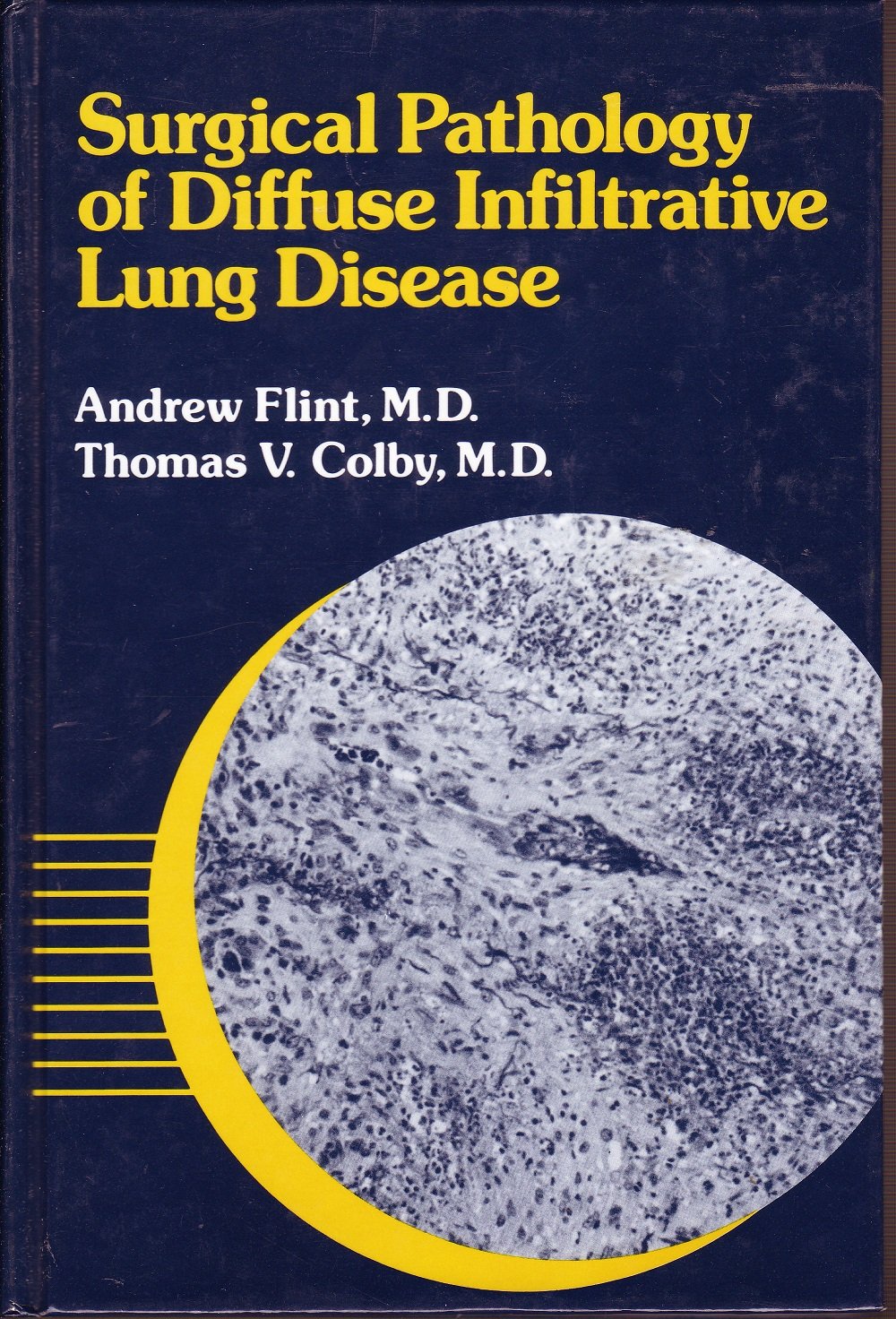 Surgical Pathology of Diffuse Infiltrative Lung Disease: Flint, Andrew ...