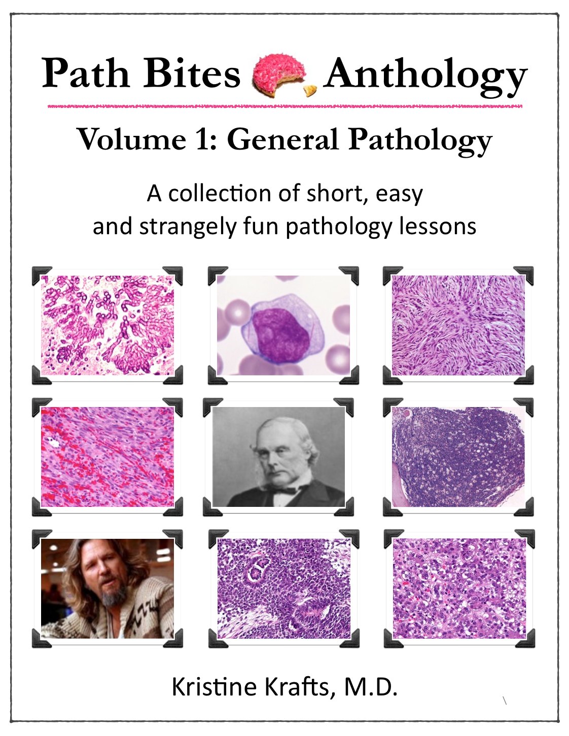 Amazon.com: Path Bites Anthology, Volume 1: General Pathology: A ...