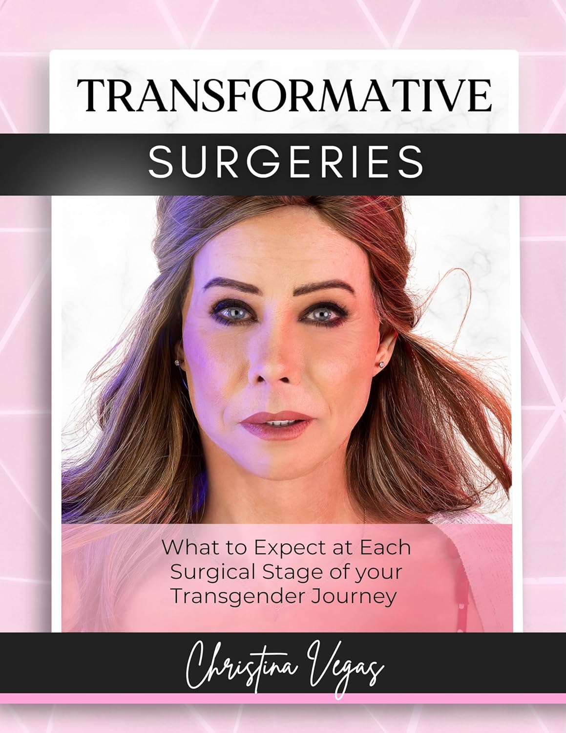 Amazon.com: TRANSFORMATIVE SURGERIES: What to Expect at Each Surgical ...