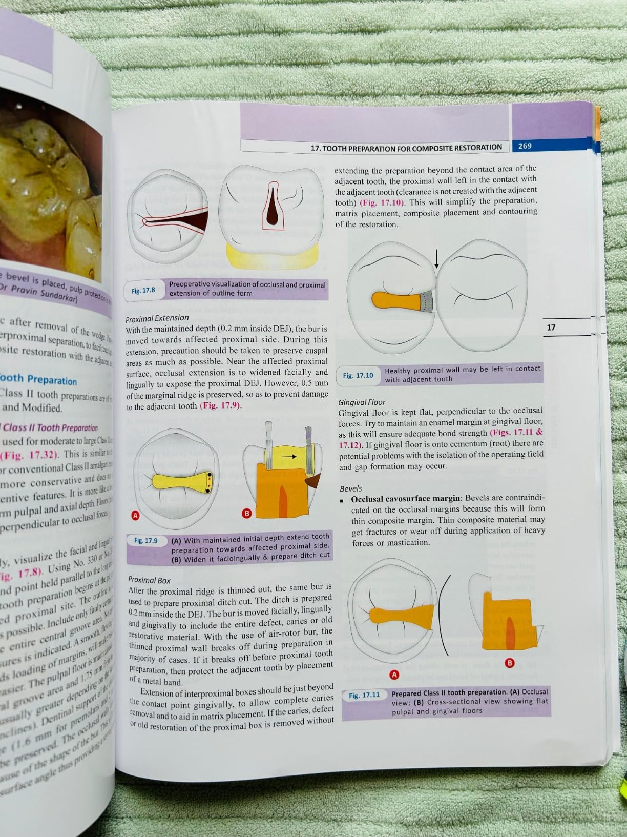 Buy Textbook of Conservative & Restorative Dentistry (Operative ...