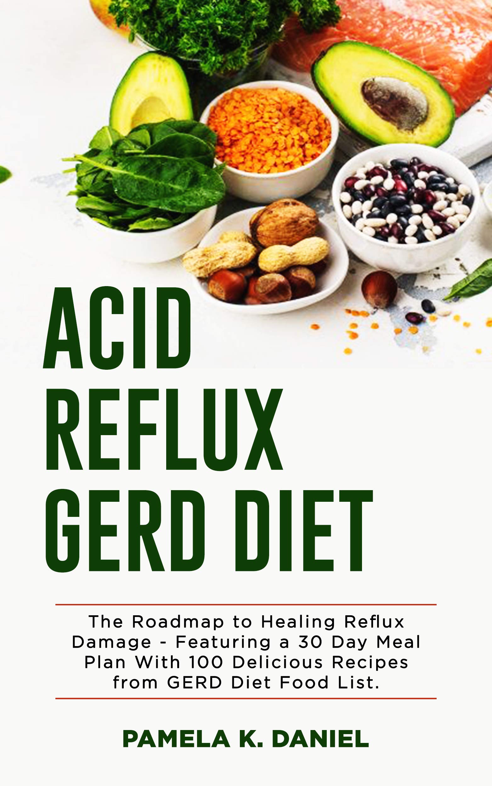 Acid Reflux Gerd Diet The Roadmap To Healing Reflux Damage | Desertcart ...