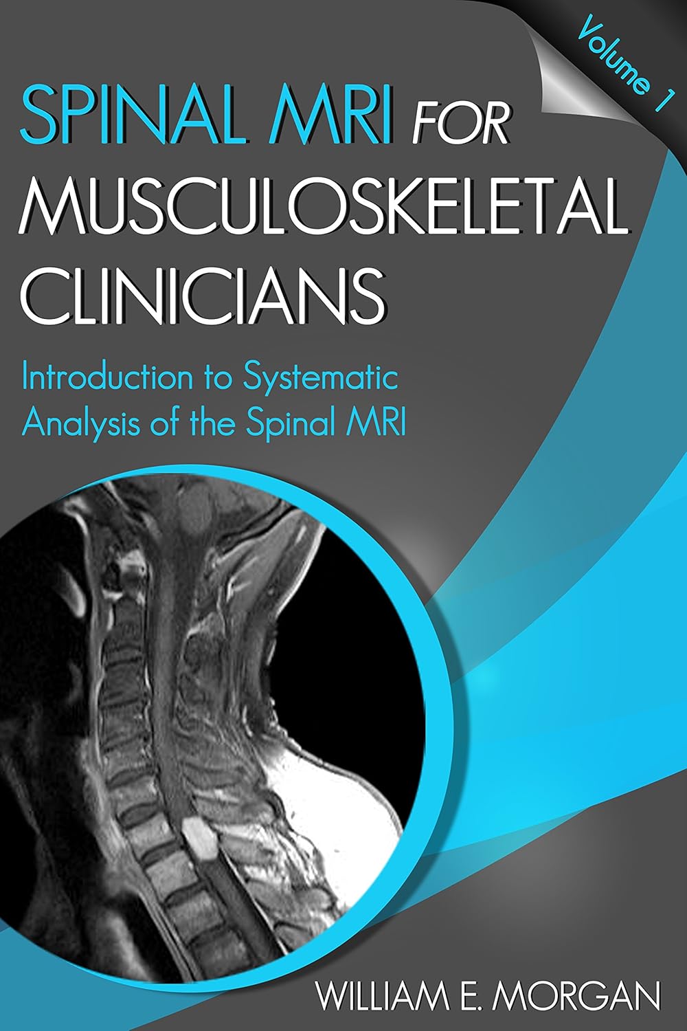 Amazon.com: Introduction to Systematic Analysis of the Spinal MRI ...