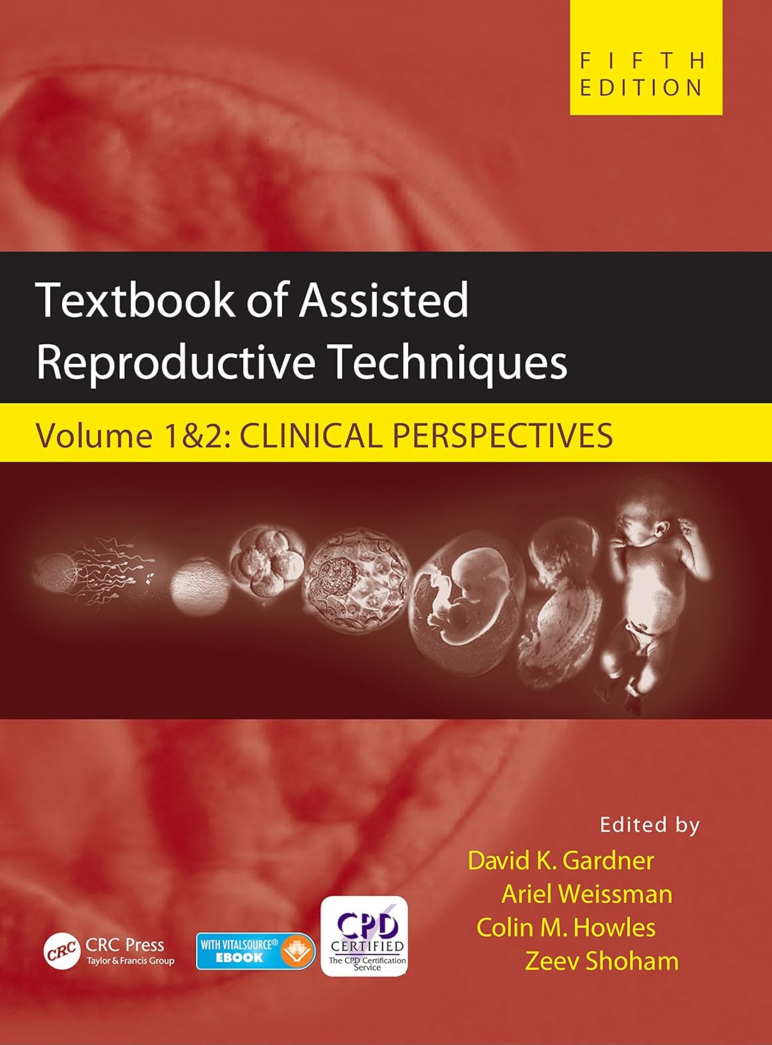 Amazon.com: Textbook of Assisted Reproductive Techniques: Two Volume ...