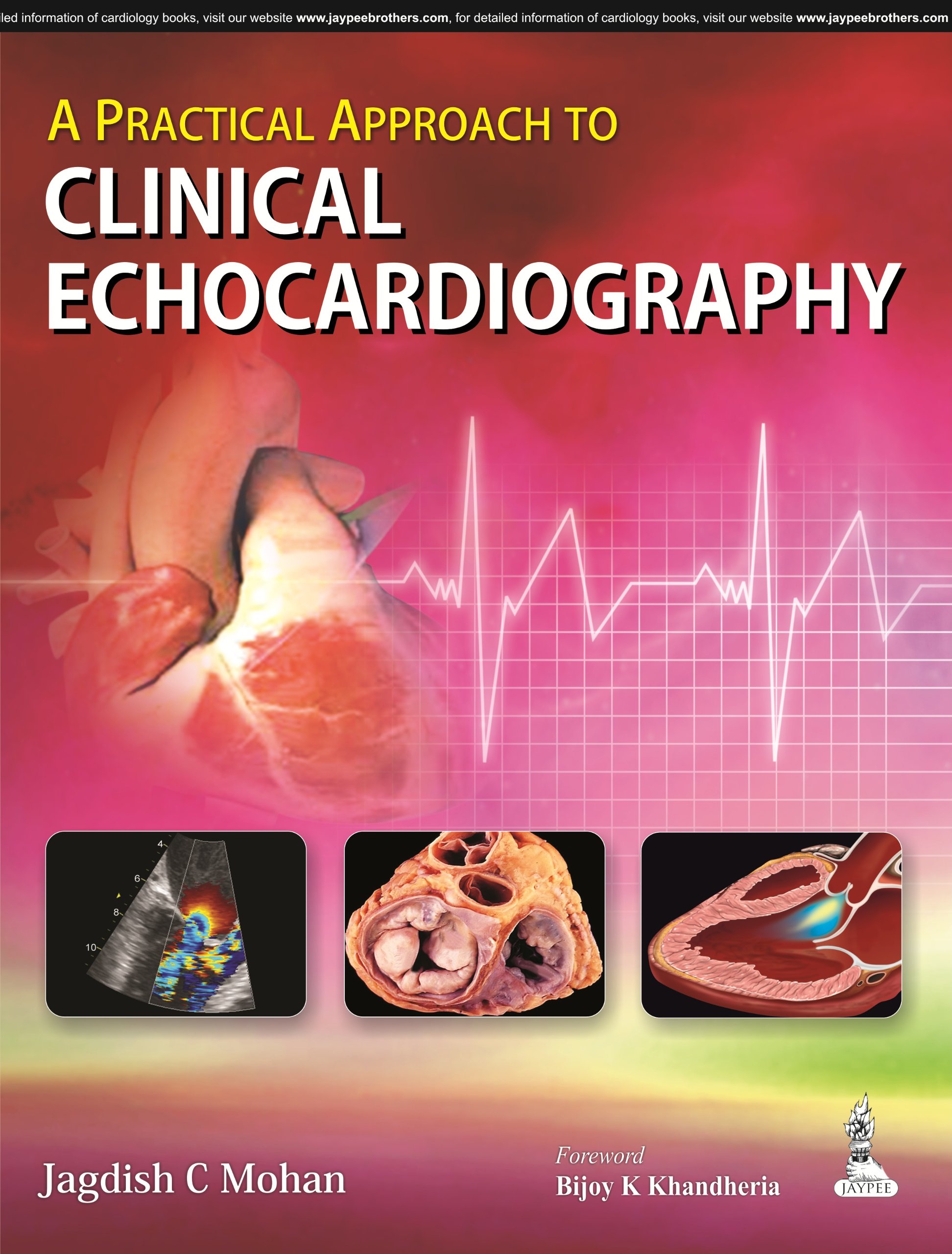 Buy A Practical Approach to Clinical Echocardiography Book Online at ...