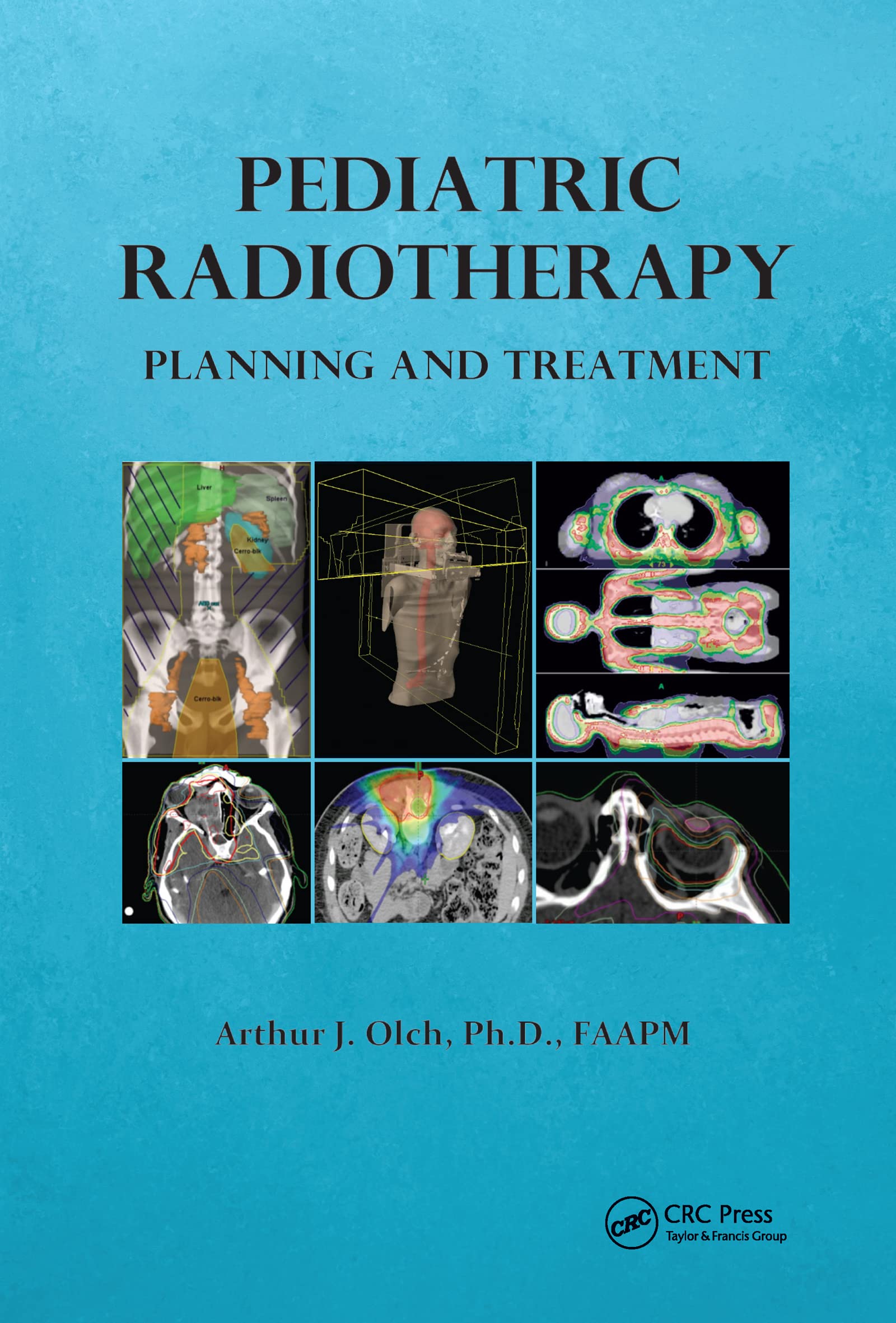 Pediatric Radiotherapy Planning and Treatment: 9781420085099: Medicine ...