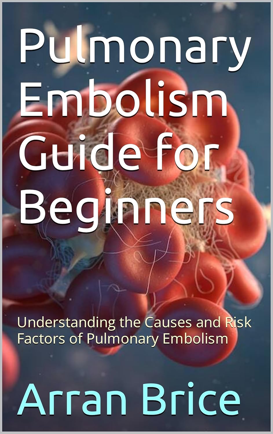 Pulmonary Embolism Guide for Beginners: Understanding the Causes and ...