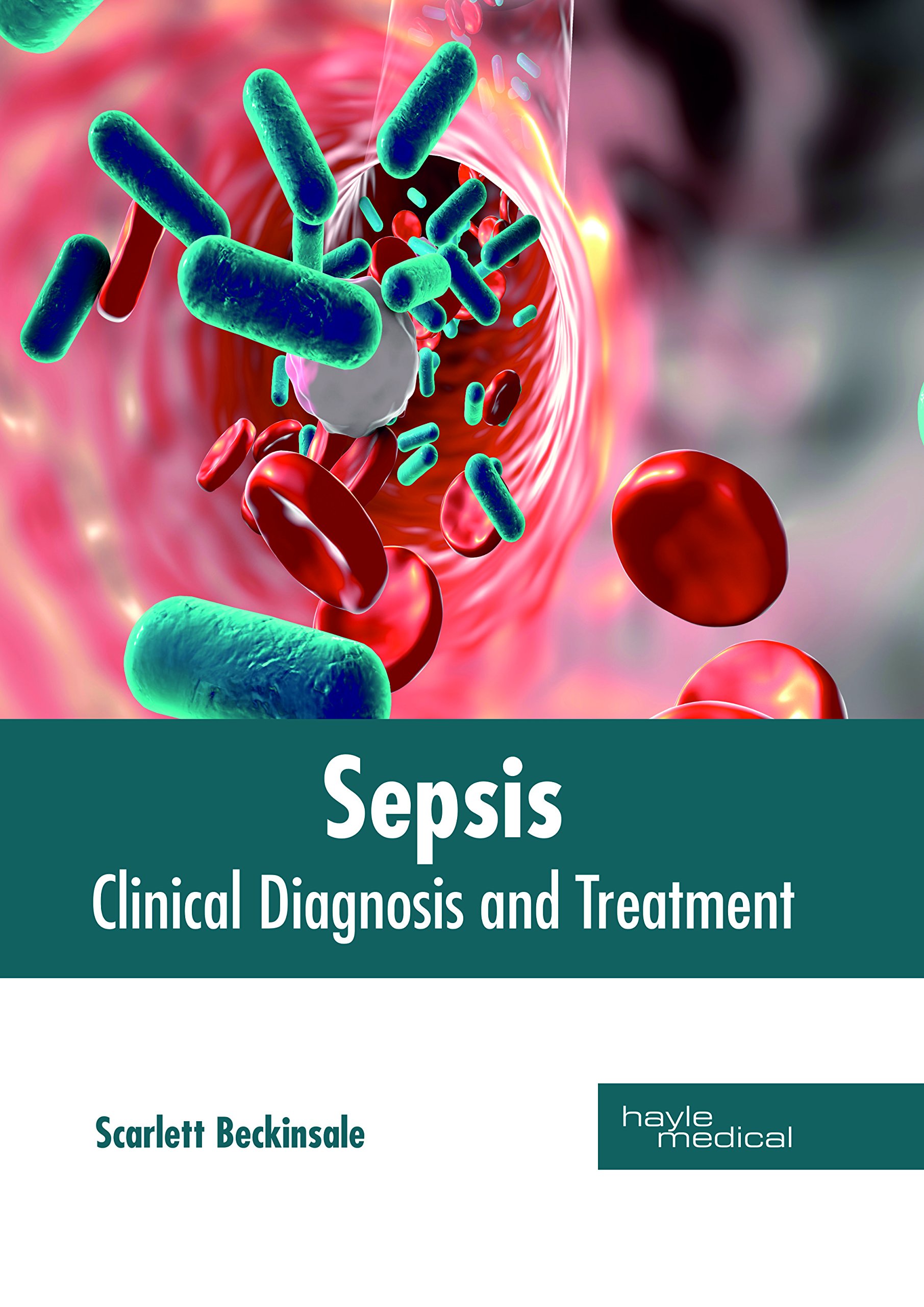 Sepsis: Clinical Diagnosis and Treatment: Beckinsale, Scarlett ...