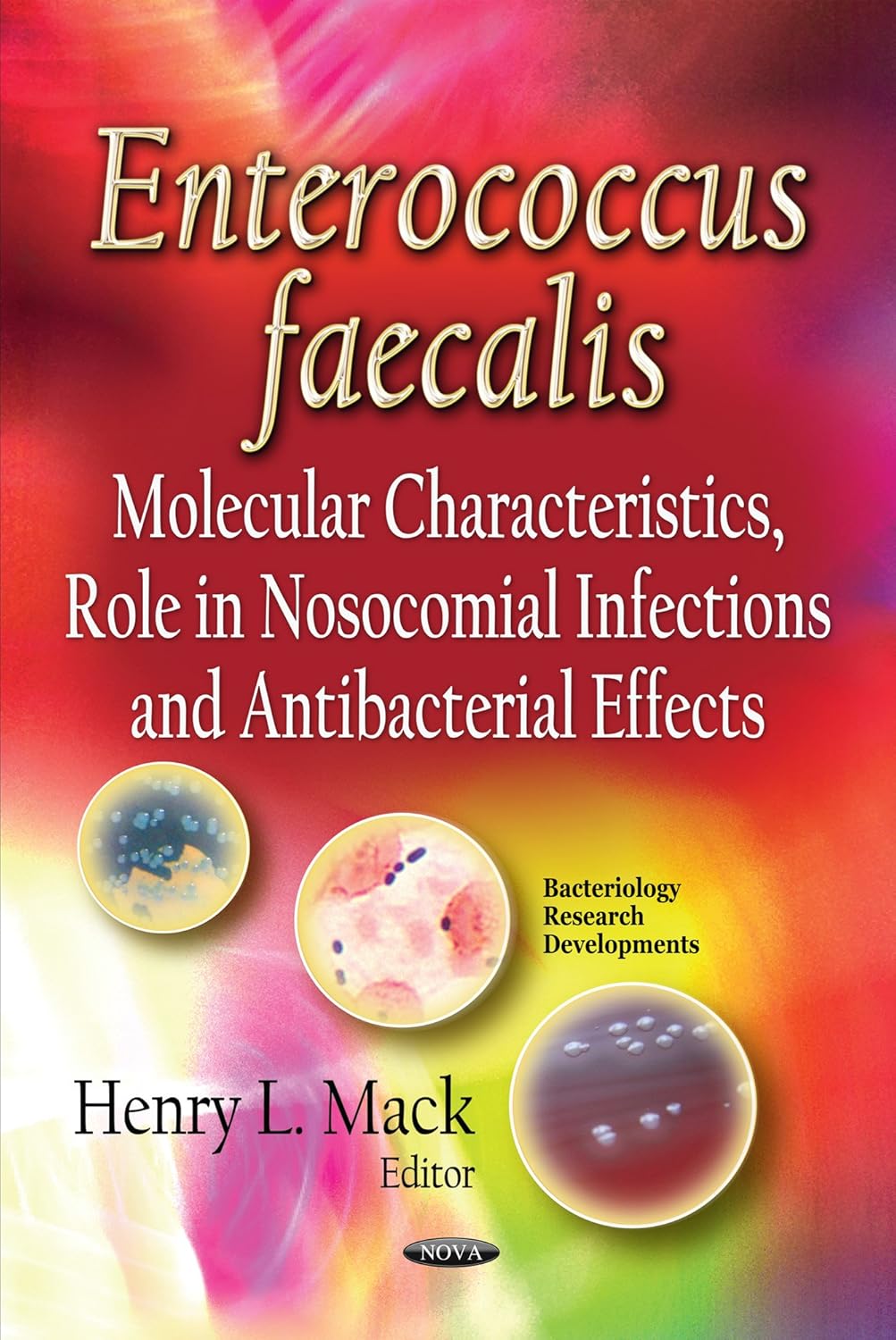 ENTEROCOCCUS FAECALIS MOLECULAR CHARA: Molecular Characteristics, Role ...